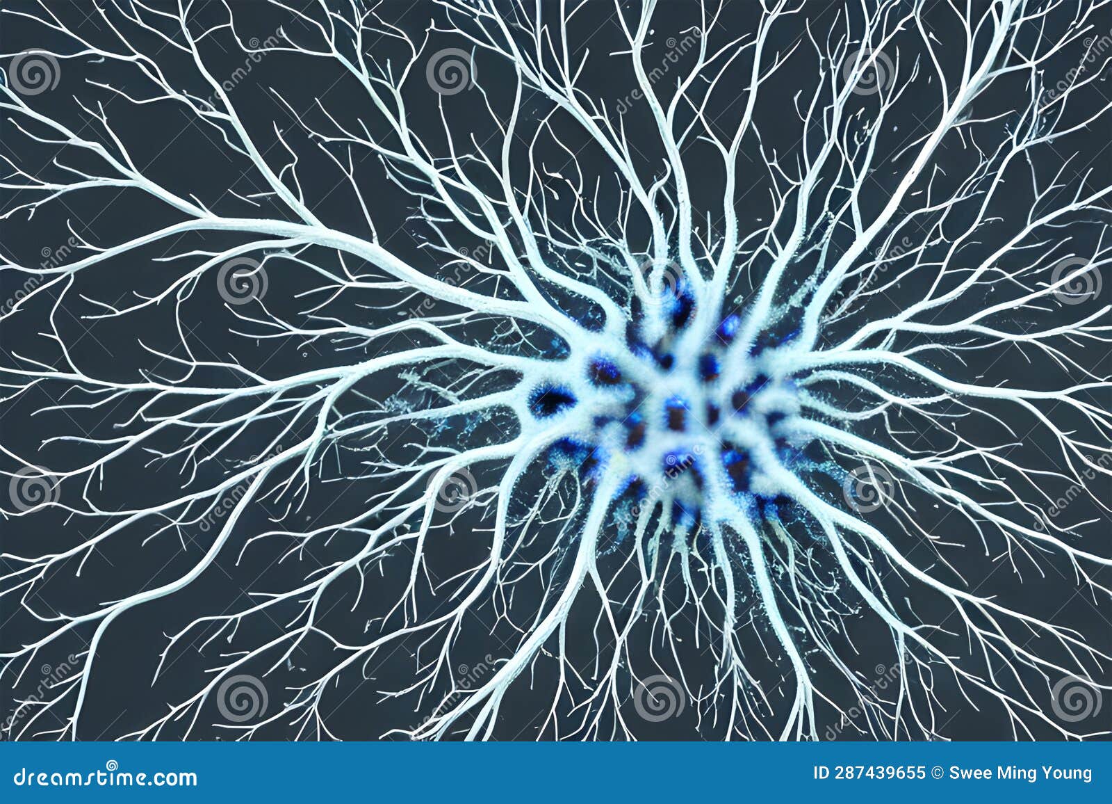 A Cluster of Neuron Floats and Branches Out with Axons and Dendrites of ...