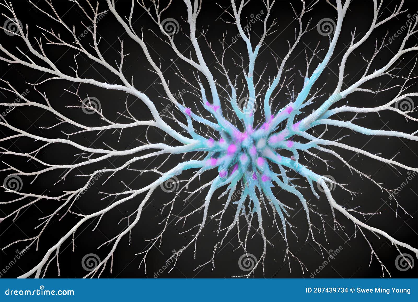 A Cluster of Neuron Floats and Branches Out with Axons and Dendrites of ...