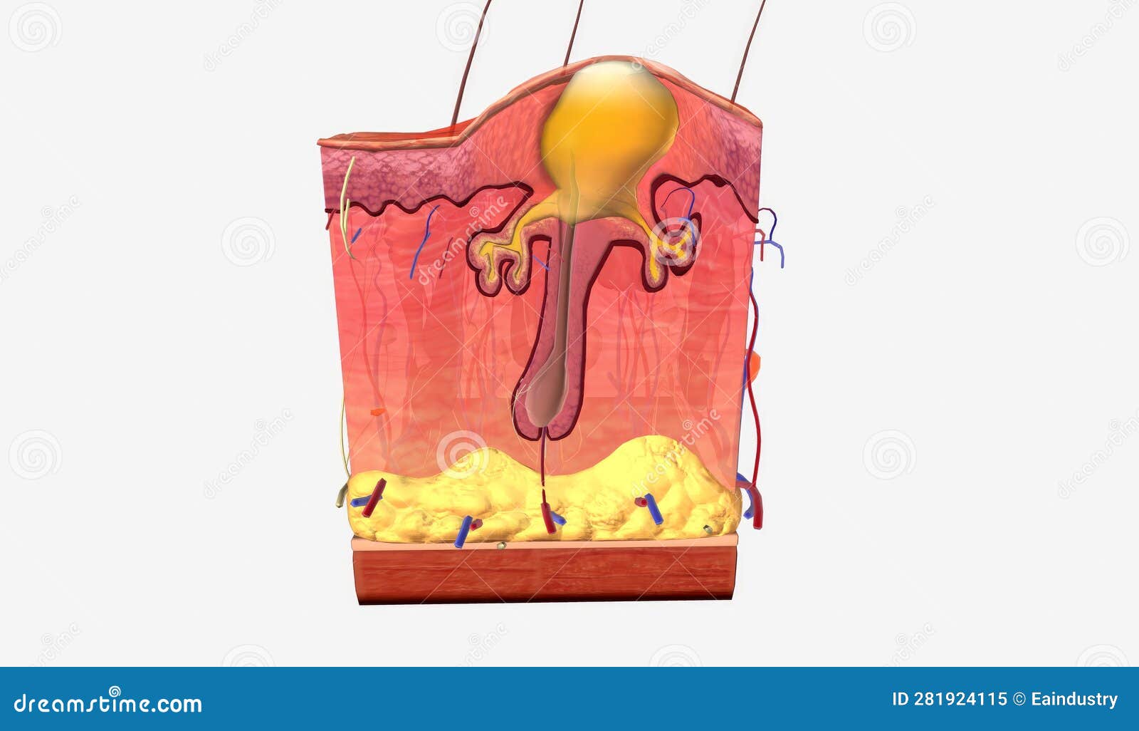 Cne Scars Take on Two Main Forms: Either a Scar Develops when There is ...