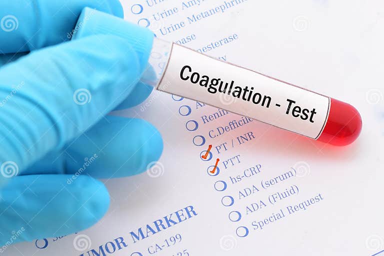 Coagulation test stock photo. Image of hospital, fibrinogen - 103015158