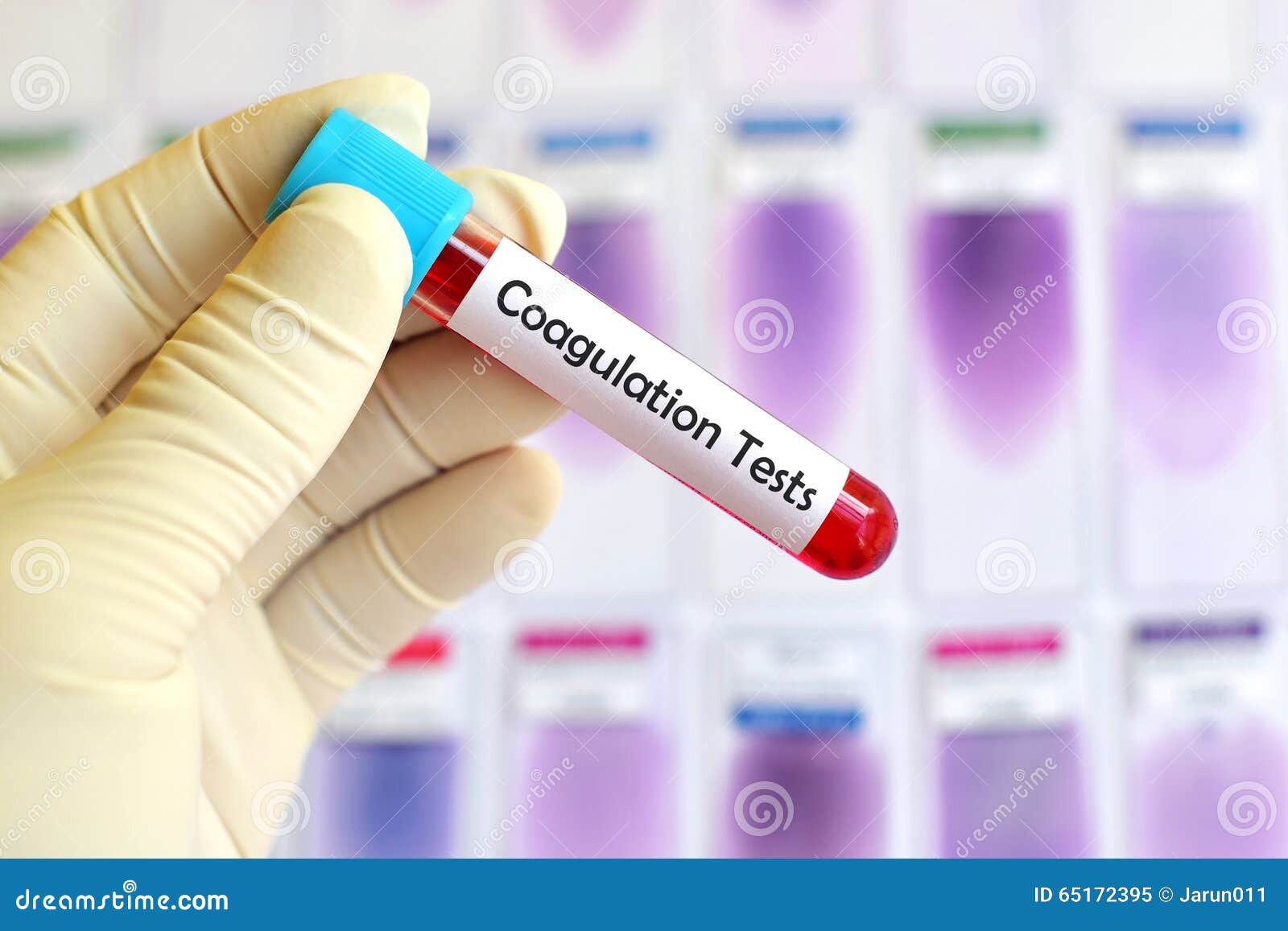 Coagulation tests stock image. Image of sodium, medical - 65172395