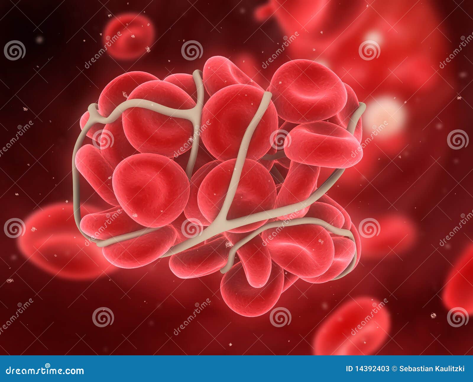 Coagulo di sangue illustrazione di stock. Illustrazione di venoso ...