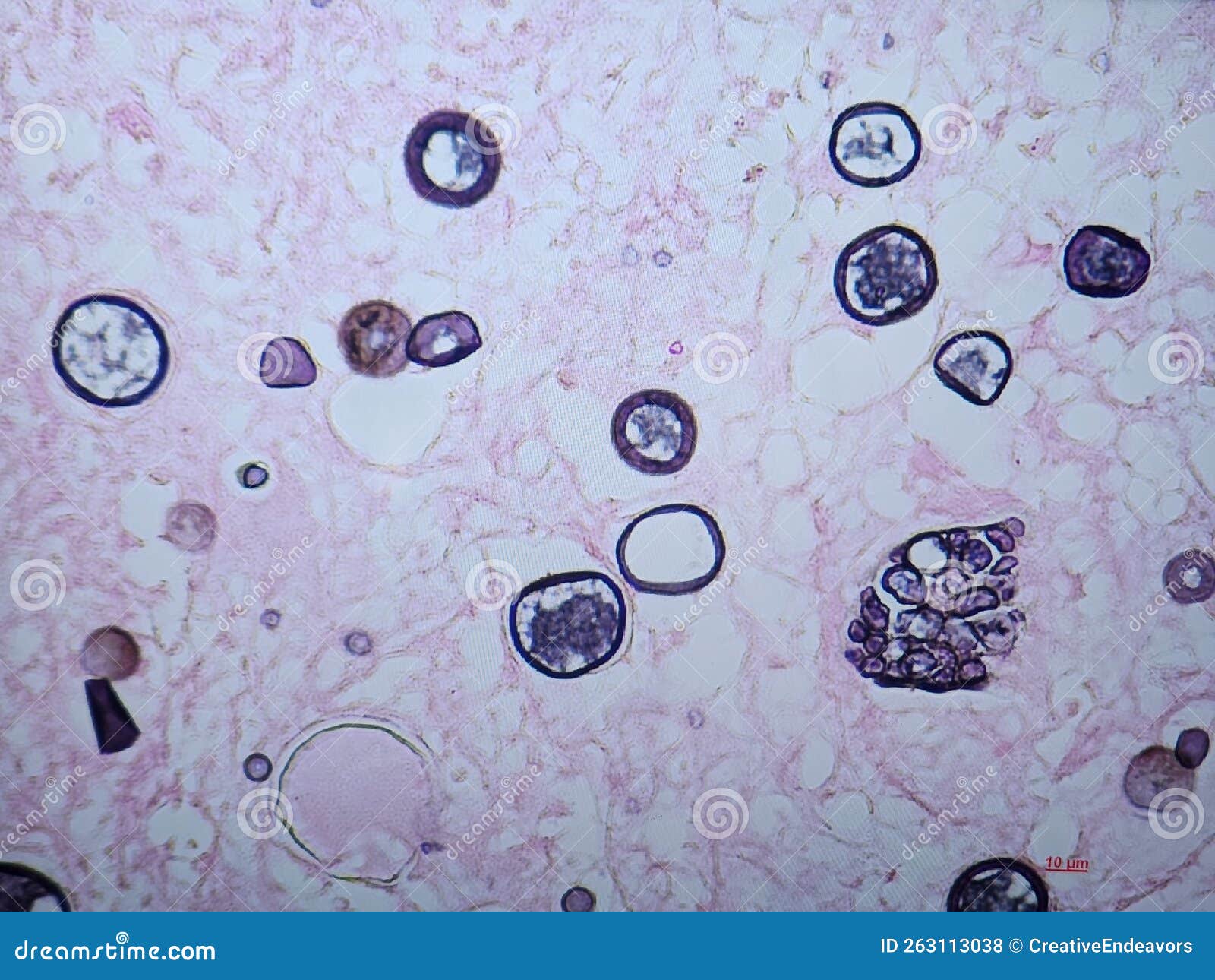 Coccidioides Imitis Spherules and Endospores on GMS Stain Stock Photo ...