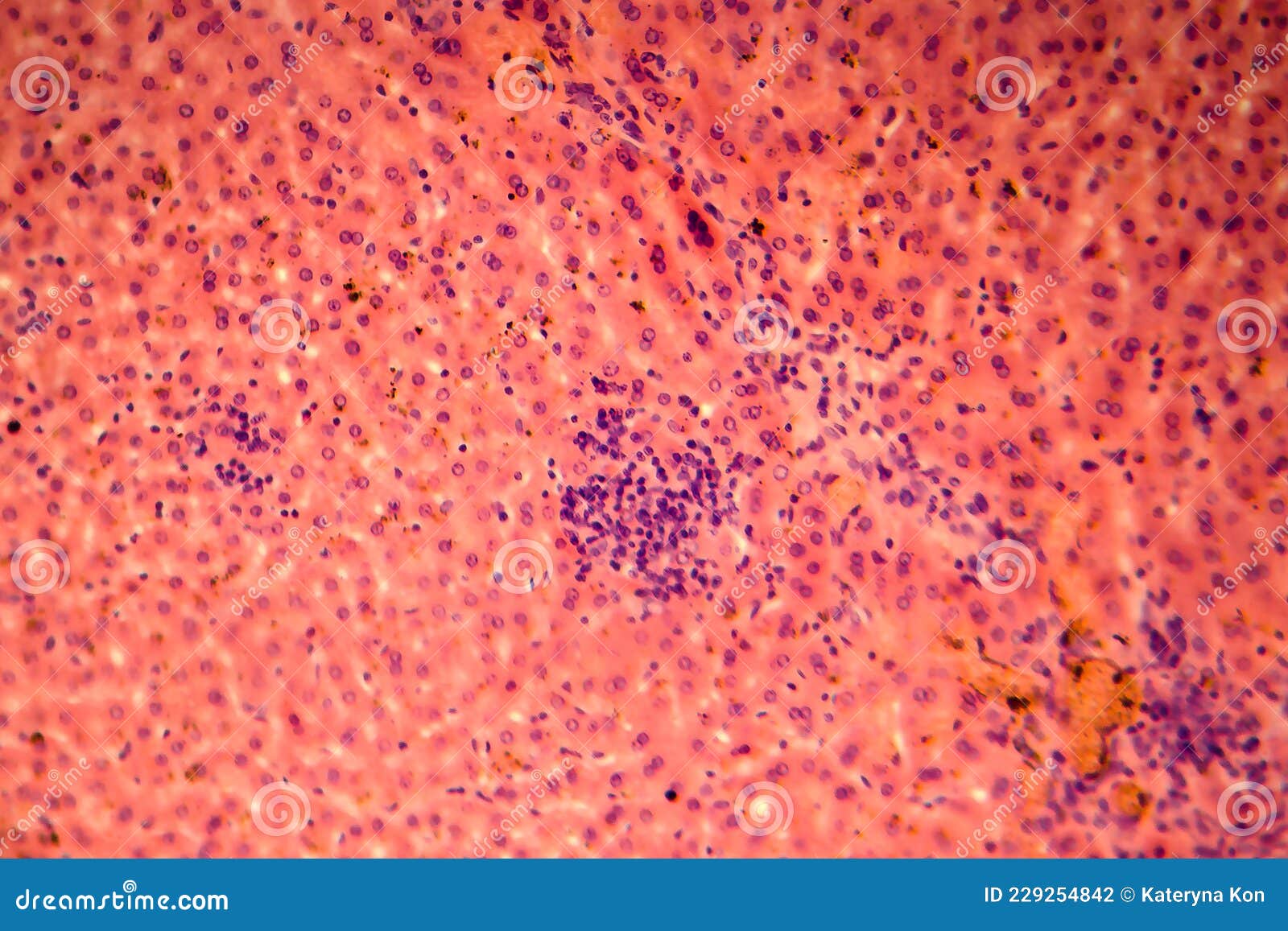 Coccidiosis, Coccidia in Liver, Light Micrograph Stock Photo - Image of ...