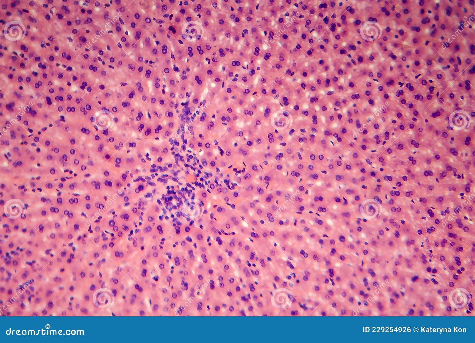 Coccidiosis, Coccidia in Liver, Light Micrograph Stock Photo - Image of ...