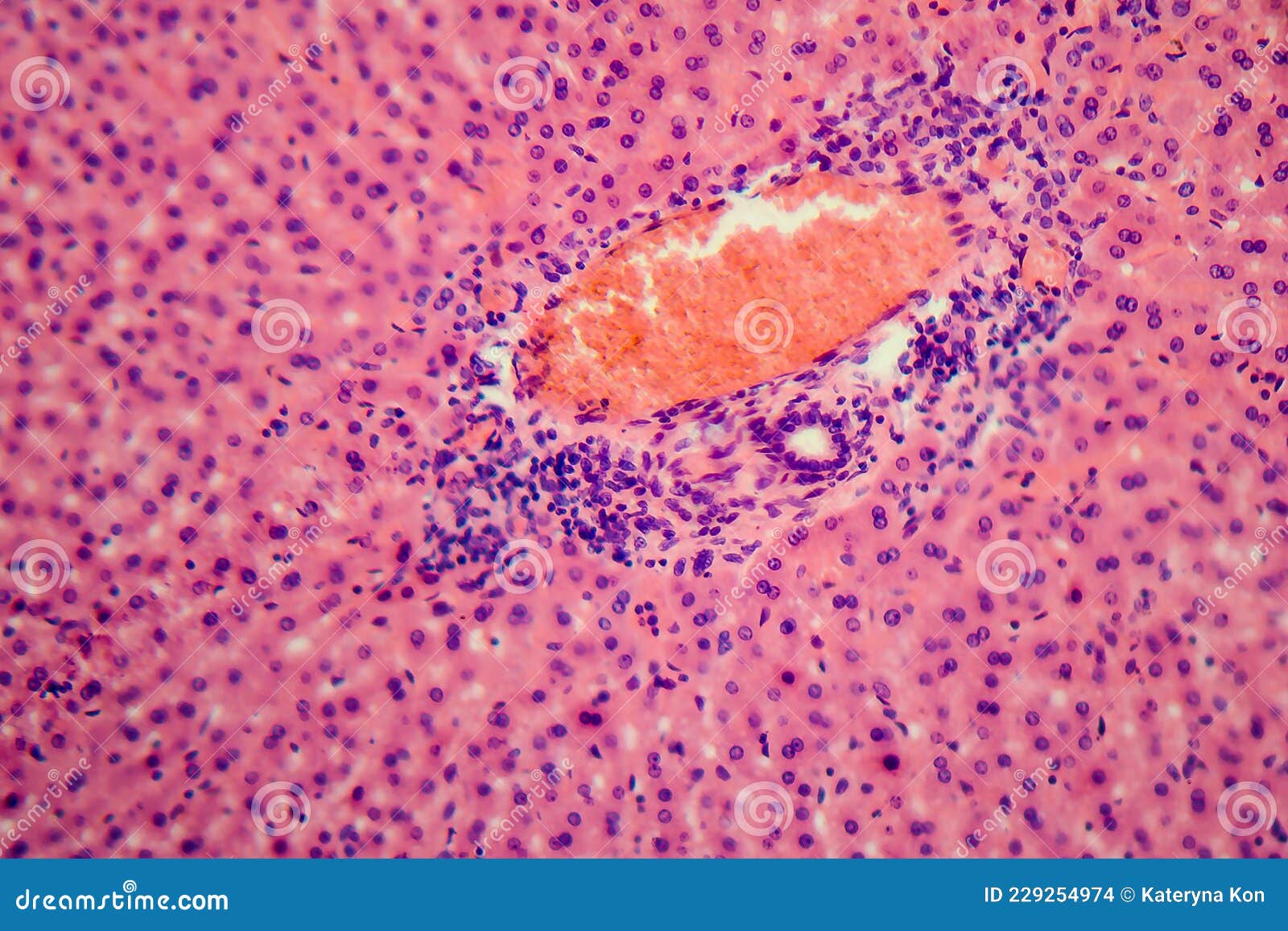 Coccidiosis, Coccidia In Liver, Light Micrograph Royalty-Free Stock ...