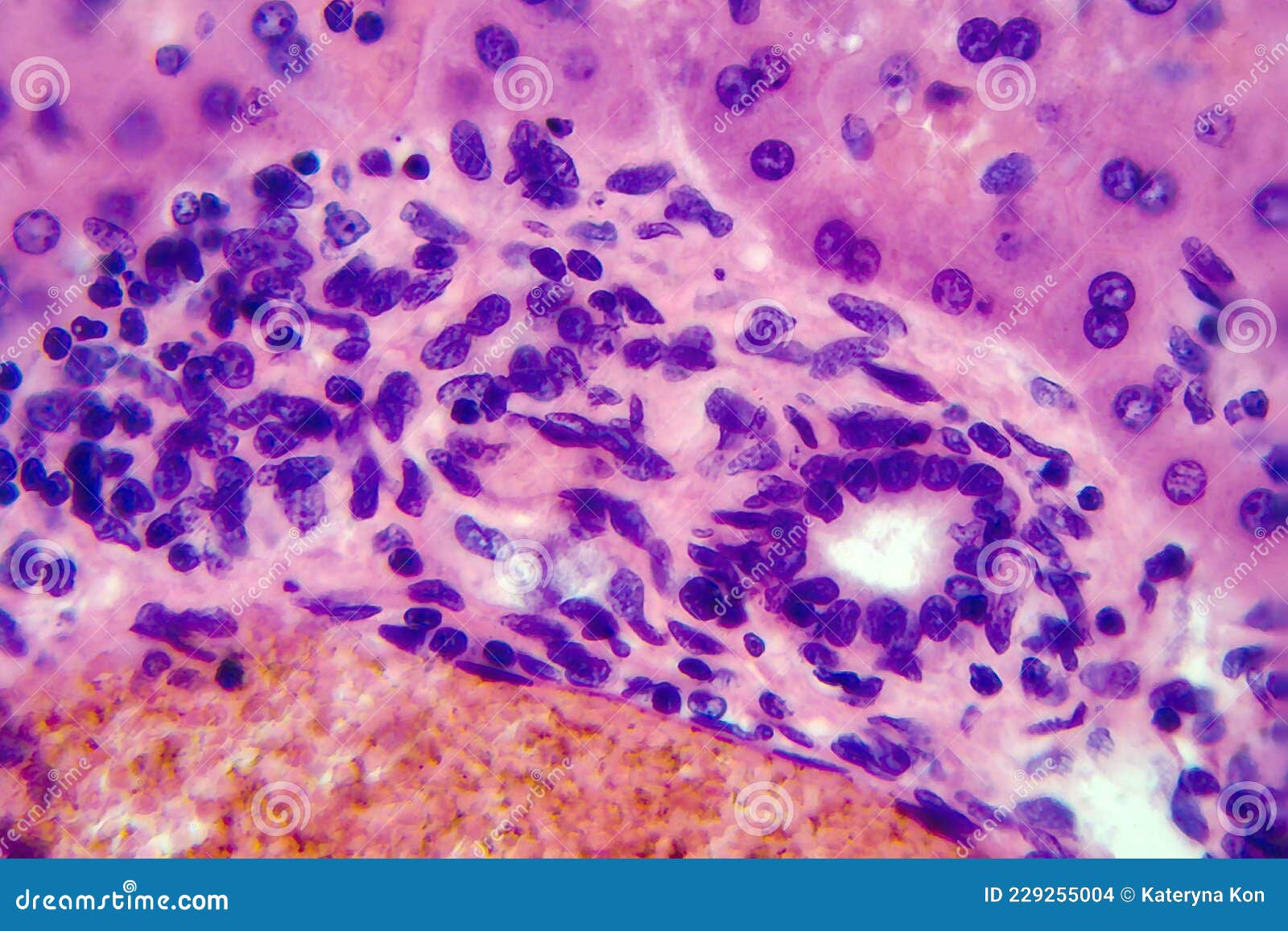 Coccidiosis, Coccidia In Liver, Light Micrograph Stock Photography ...