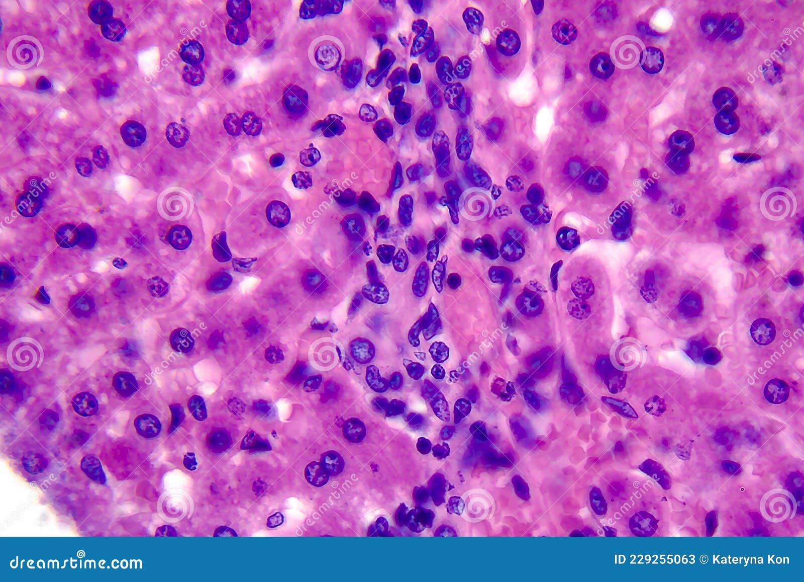 Coccidiosis, Coccidia in Liver, Light Micrograph Stock Image - Image of ...