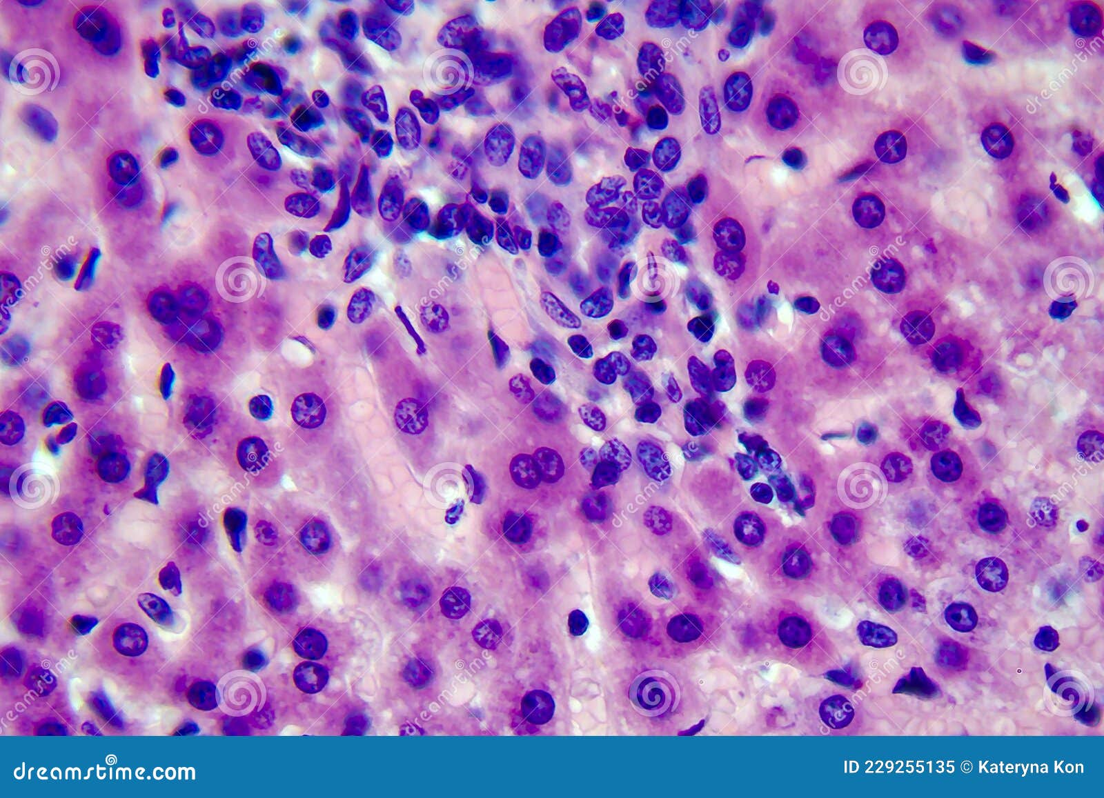 Coccidiosis, Coccidia In Liver, Light Micrograph Stock Image ...