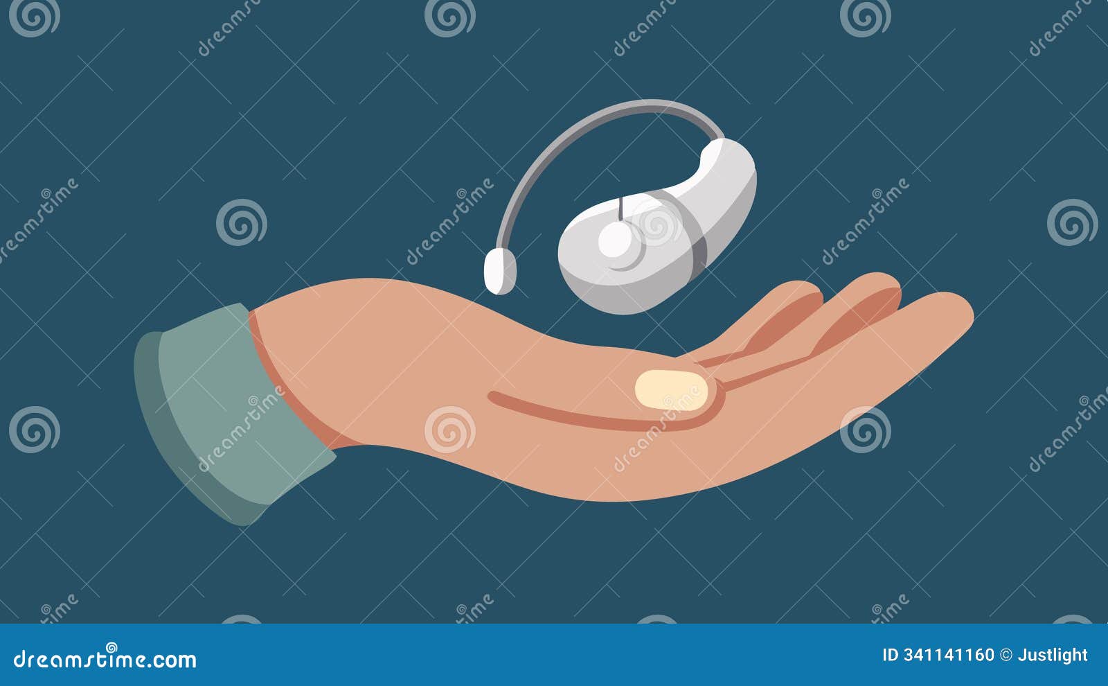Cochlear Implant Diagram an Educational Illustration Featuring the ...