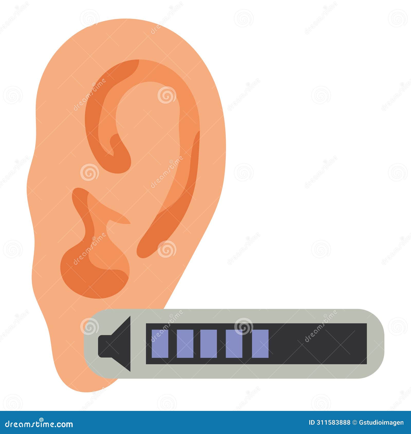 Cochlear Implant Volume Levels Stock Illustration - Illustration of ...