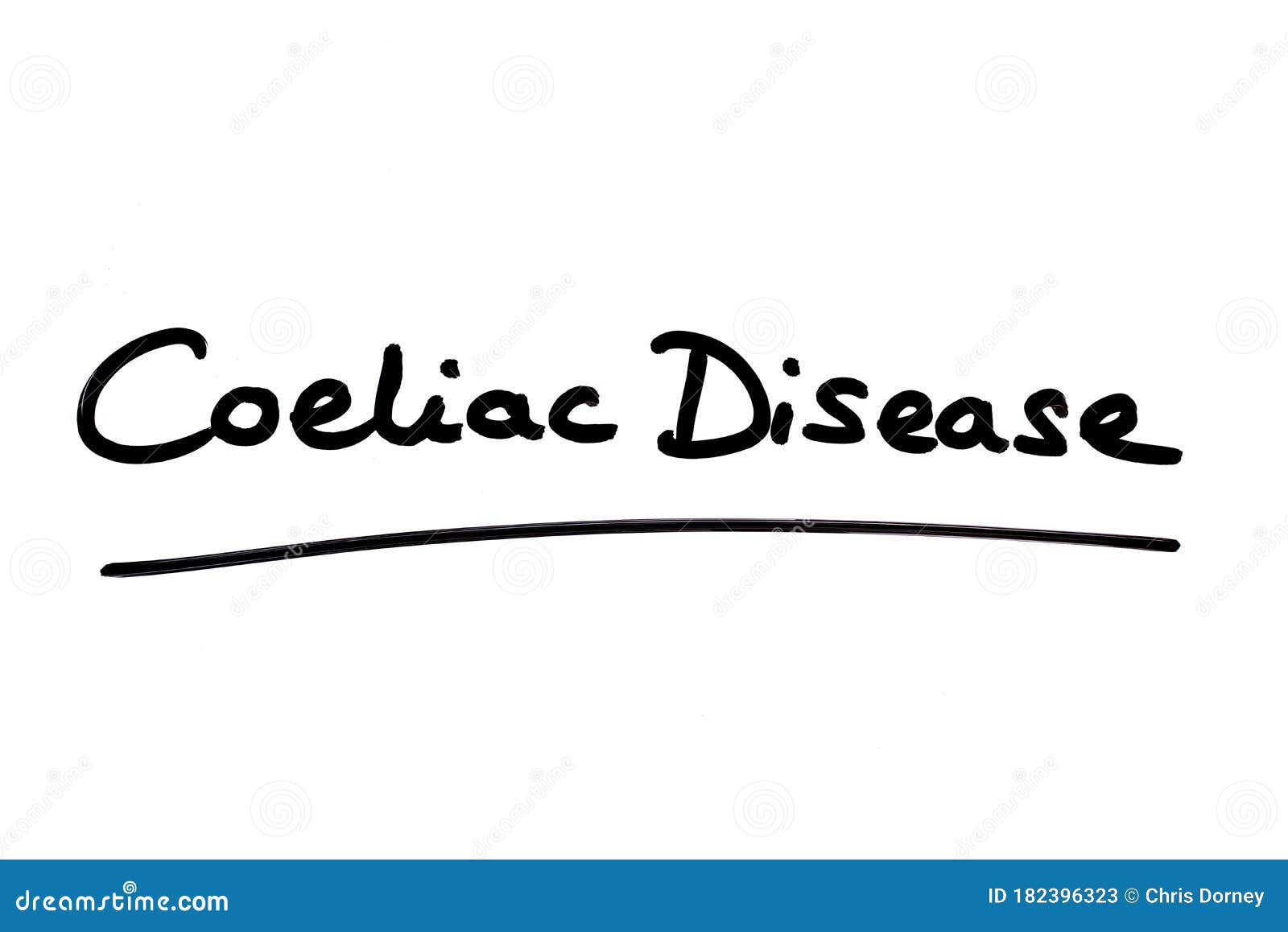 Coeliac Disease. Cross Section Of Small Bowel With Normal Villi And ...