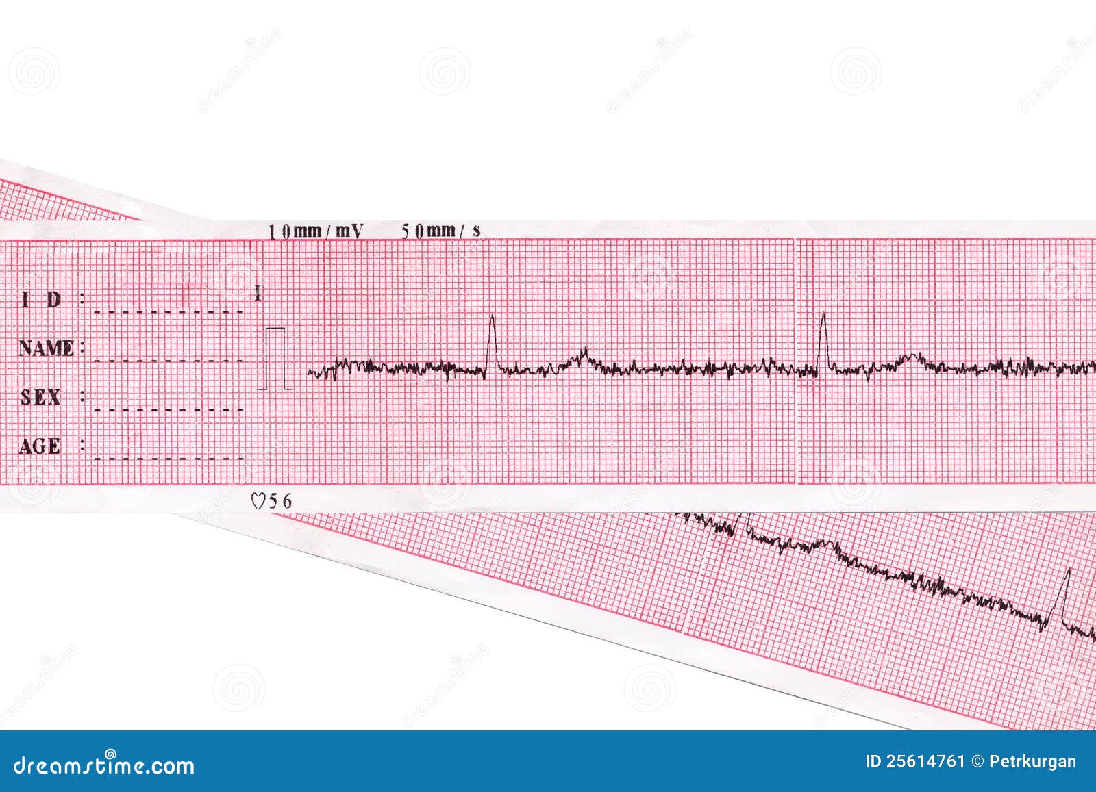 Coeur. Cardiogramme image stock. Image du milieux, rouge - 25614761