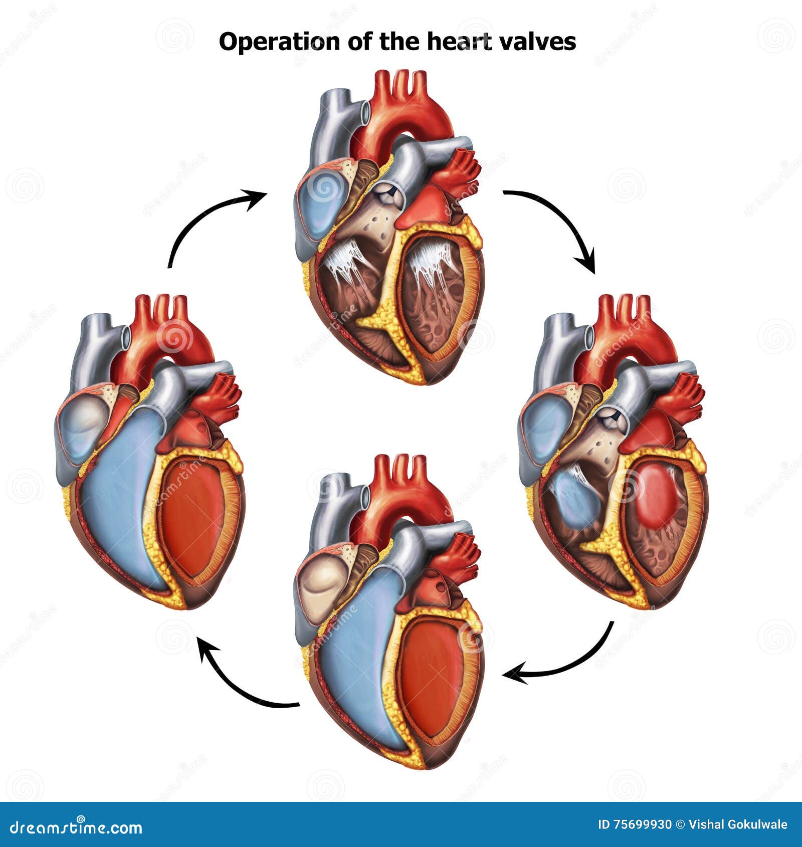 Coeur-valve-opération illustration stock. Illustration du myocarde ...