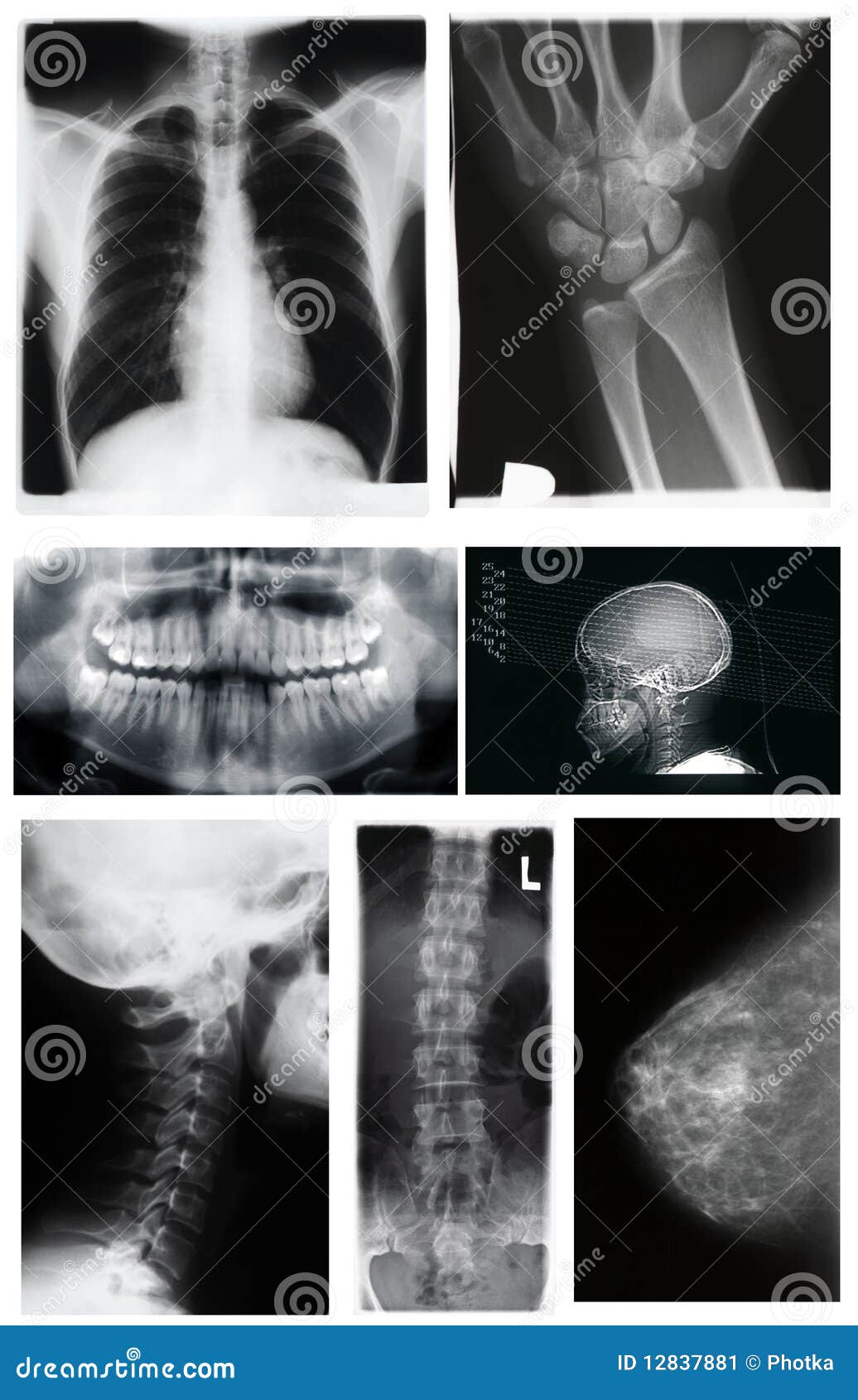 Colección de los rayos X imagen de archivo. Imagen de prueba - 12837881