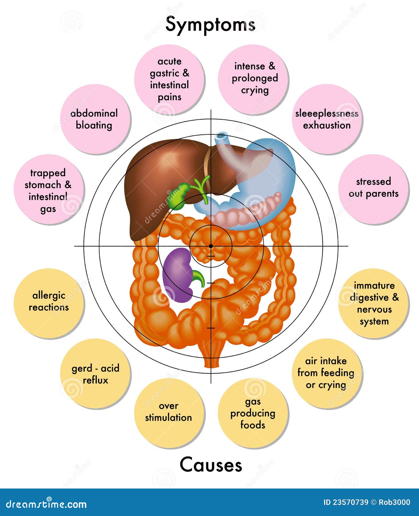 Colique illustration de vecteur. Illustration du colique - 23570739
