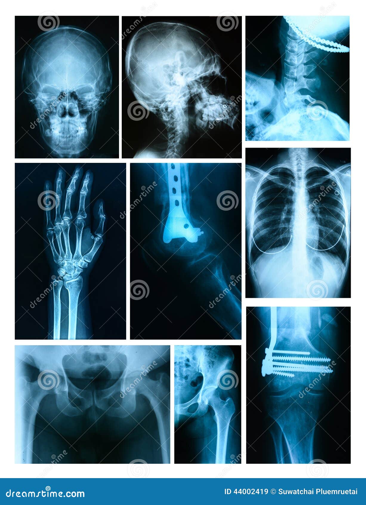 Collage De Muchas Radiografías Imagen de archivo - Imagen de medicina ...