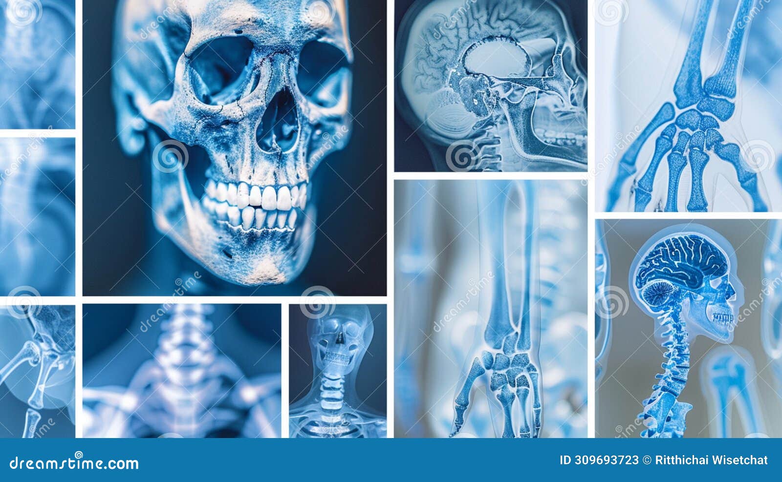A Collage of Detailed Blue-toned X-ray Images Showcasing Various Angles ...