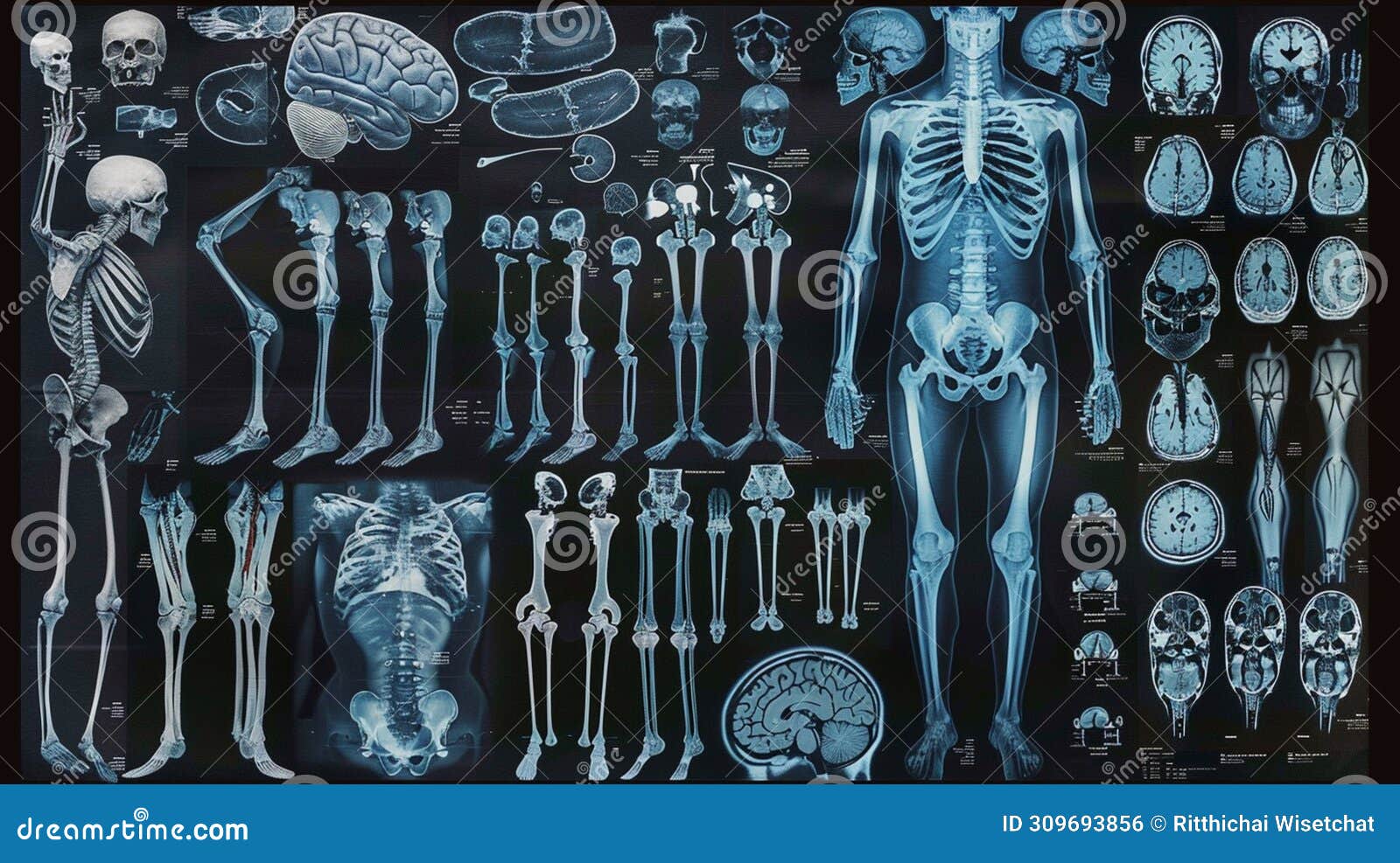 A Collage of Detailed Blue-toned X-ray Images Showcasing Various Angles ...