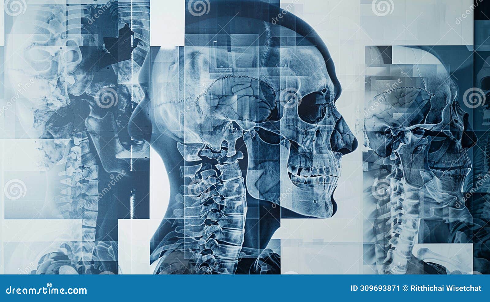 A Collage of Detailed Blue-toned X-ray Images Showcasing Various Angles ...