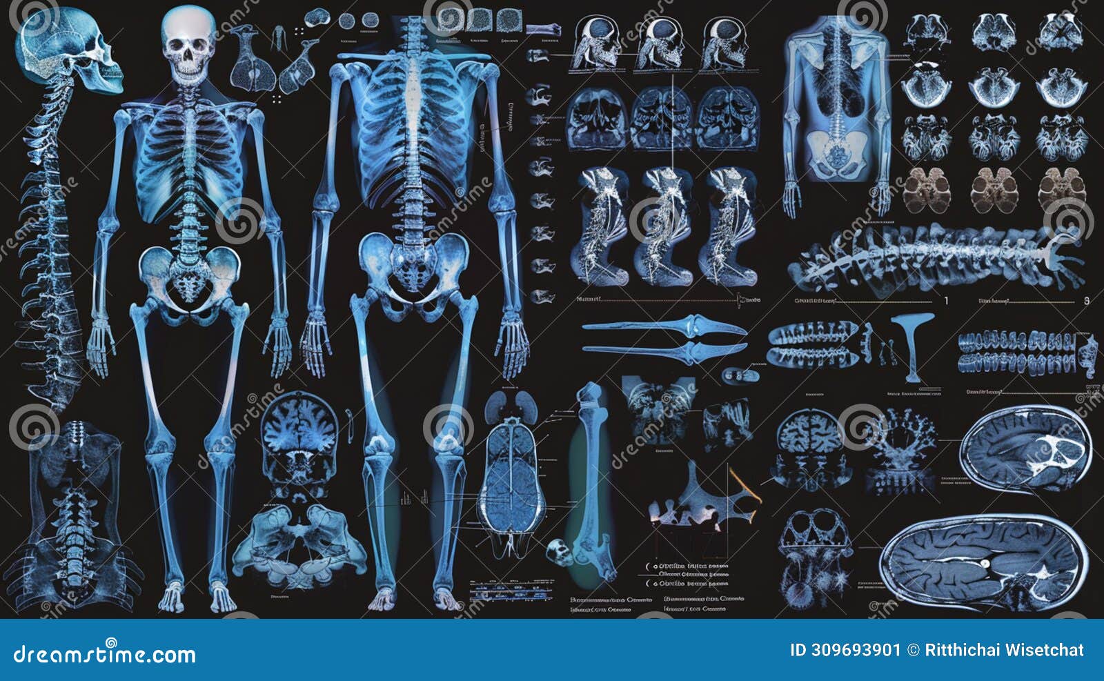 A Collage of Detailed Blue-toned X-ray Images Showcasing Various Angles ...