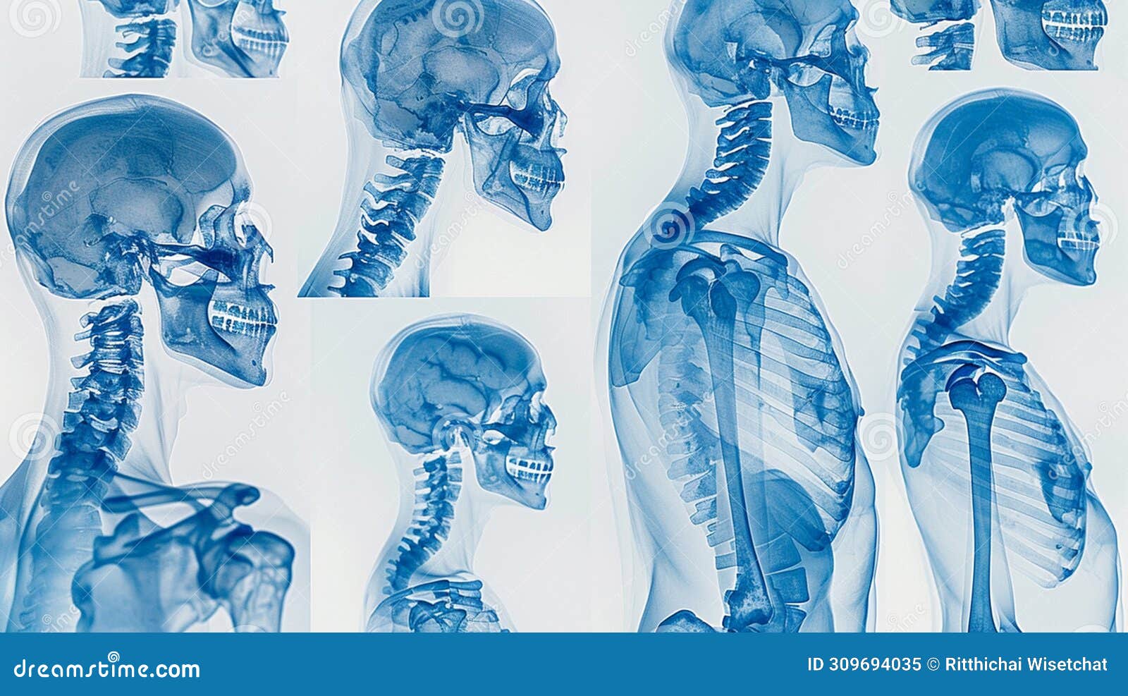A Collage of Detailed Blue-toned X-ray Images Showcasing Various Angles ...