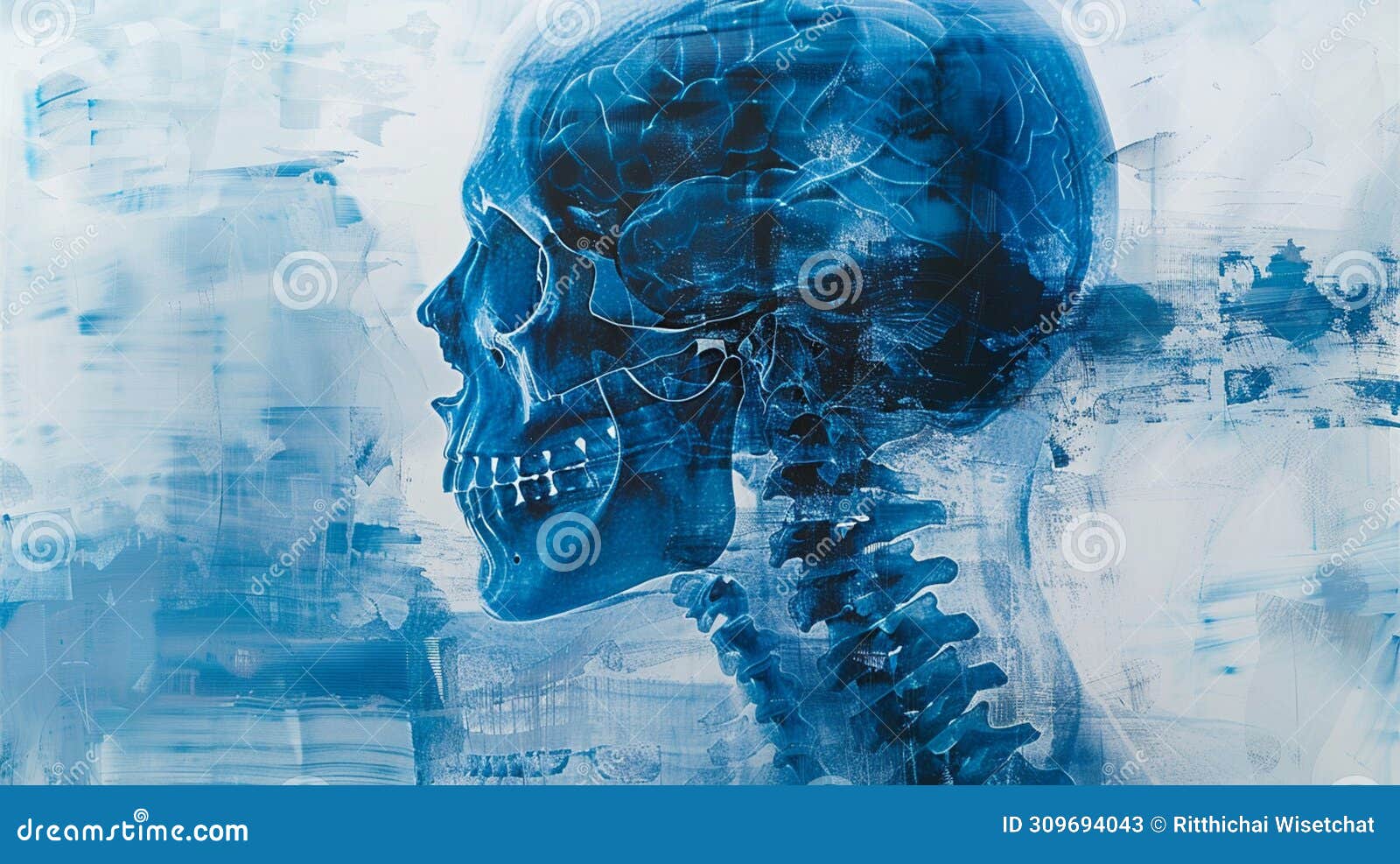 A Collage of Detailed Blue-toned X-ray Images Showcasing Various Angles ...