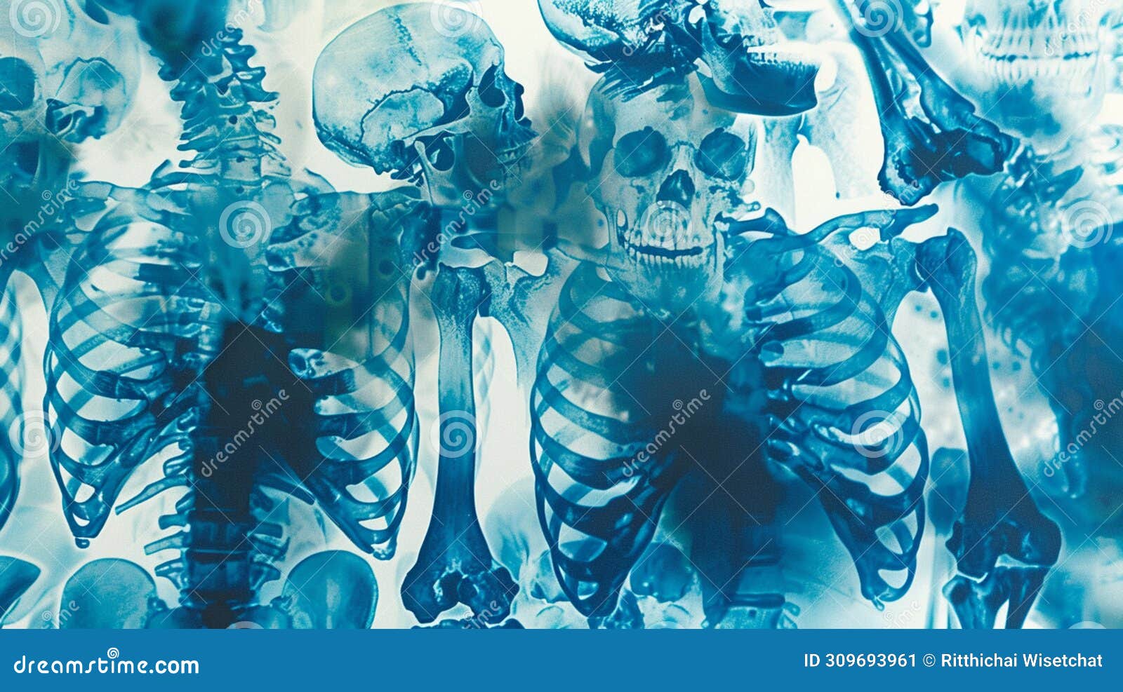 A Collage of Detailed Blue-toned X-ray Images Showcasing Various Angles ...