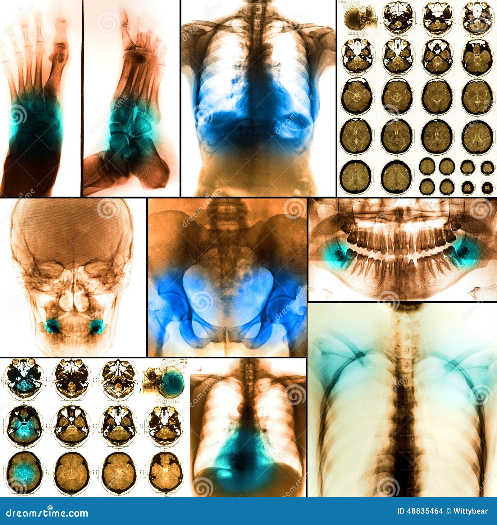 Collage of Human X-rays Photo Stock Photo - Image of medicine, organ ...