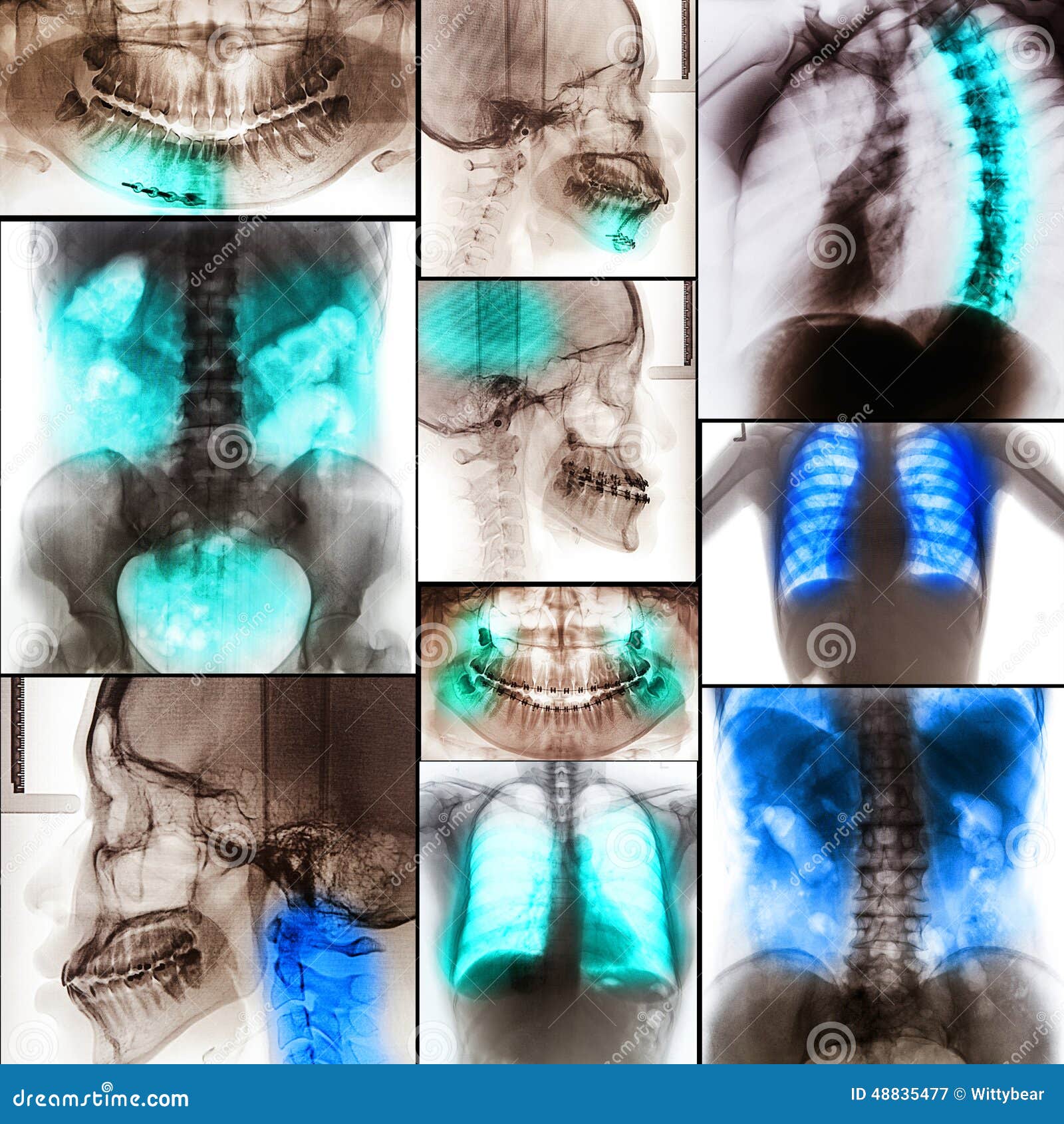 X Ray Film Of Human Mouth With Healthy Teeth. Detail Of Panoramic ...