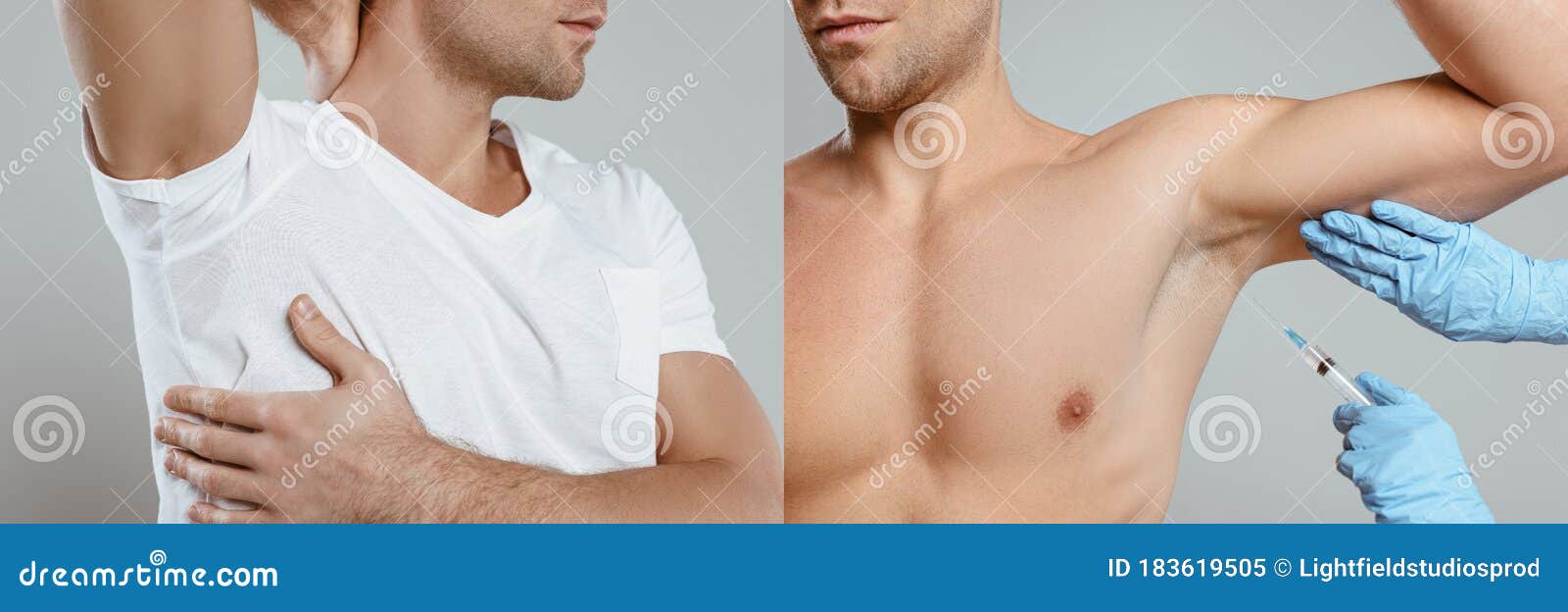Collage of Man with Sweaty Armpit and Doctor Doing Botox Injection from ...