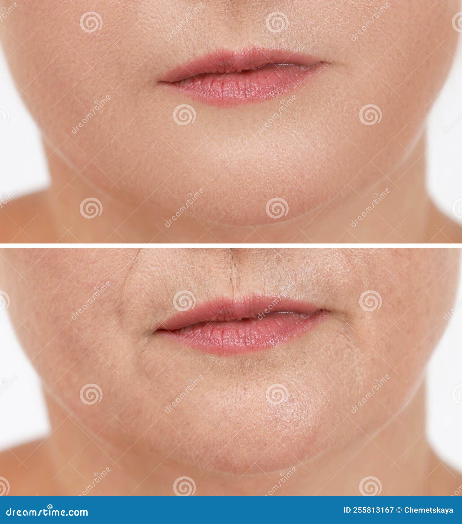 Collage With Photos Of Mature Woman Having Dry Skin Problem Before And