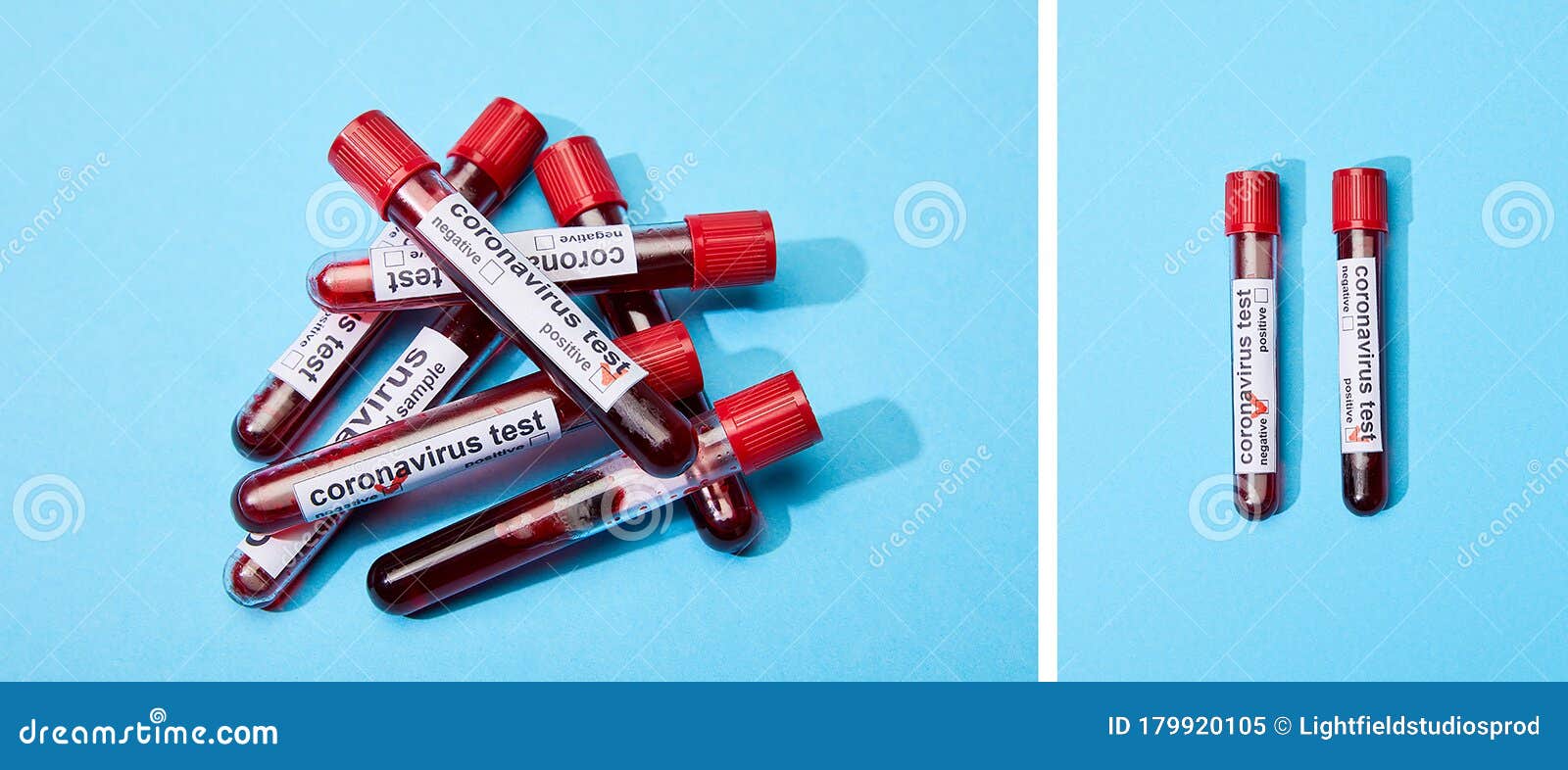 Collage of Test Tubes with Samples of Blood and Coronavirus Test ...