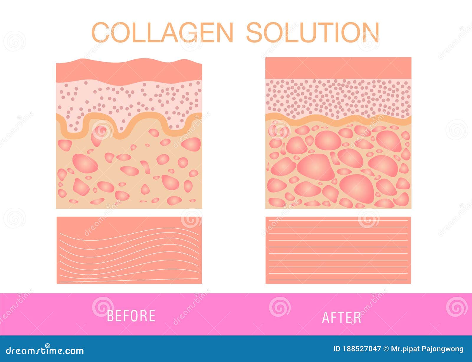 Collagen ,Protection Skin Vector Stock Vector - Illustration of female ...