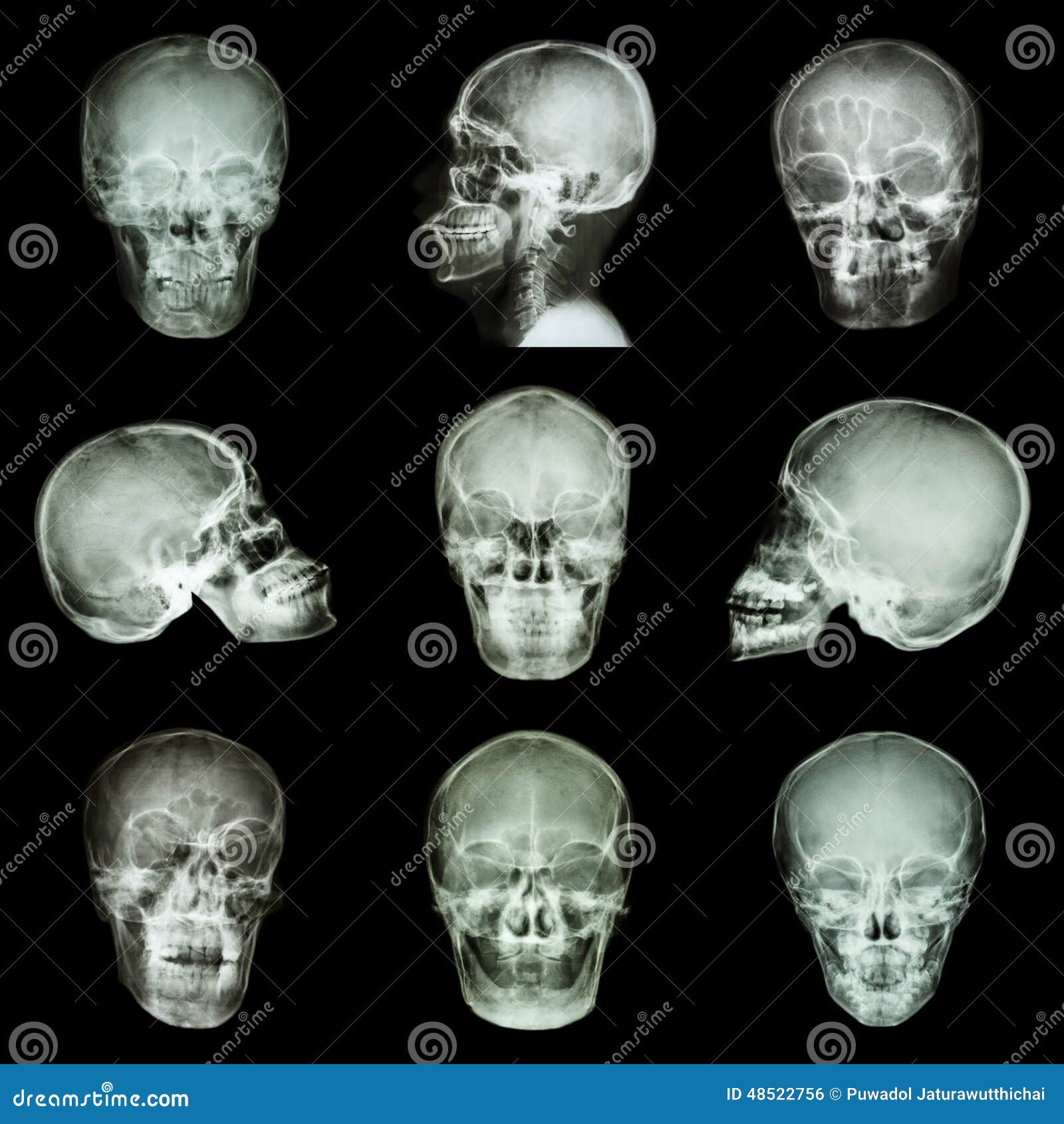 Collection Of Skull Replica Of Human Ancestors - Human Evolution ...