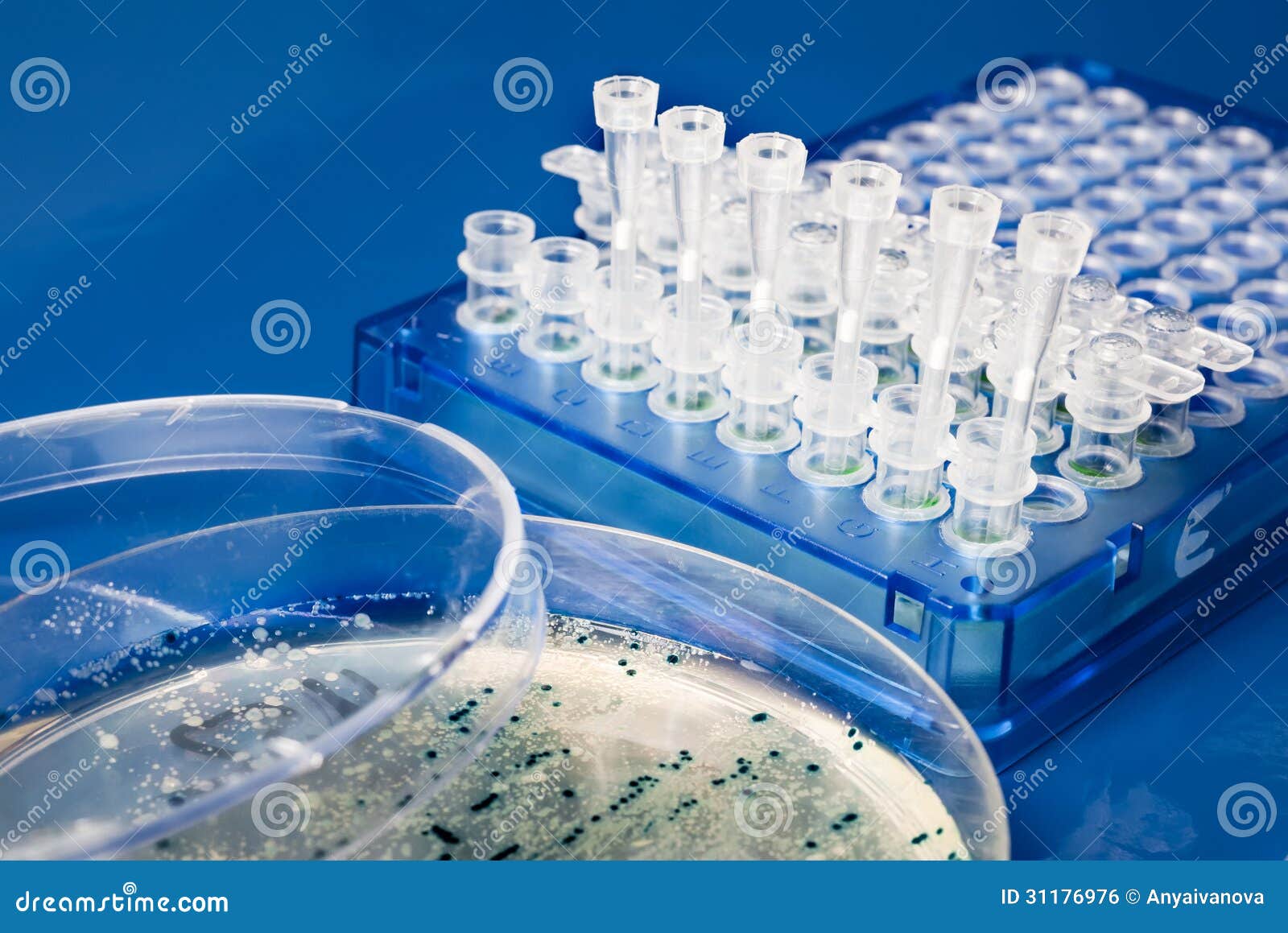 Collection of Bacterial Colonies from Agar Plate Stock Photo - Image of ...