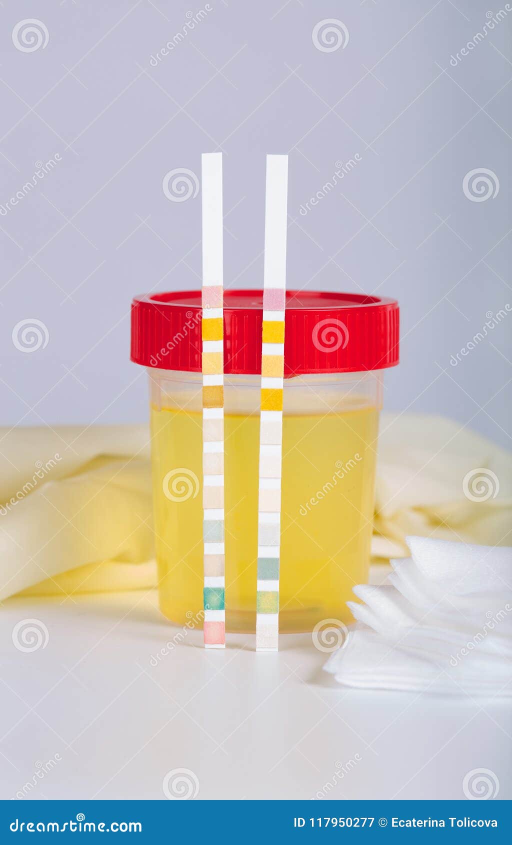 Collection Cup with Urine Test on a Table of a Lab Technician. Stock ...