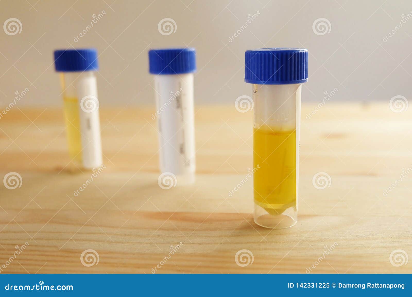 Collection Cup of Urine on Wooden Background Stock Image - Image of ...