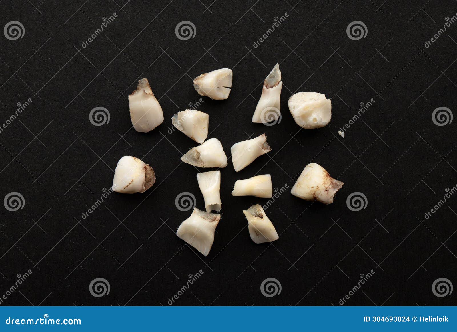 Collection of Deciduous Teeth Which are Also Known As Baby Teeth. Stock ...