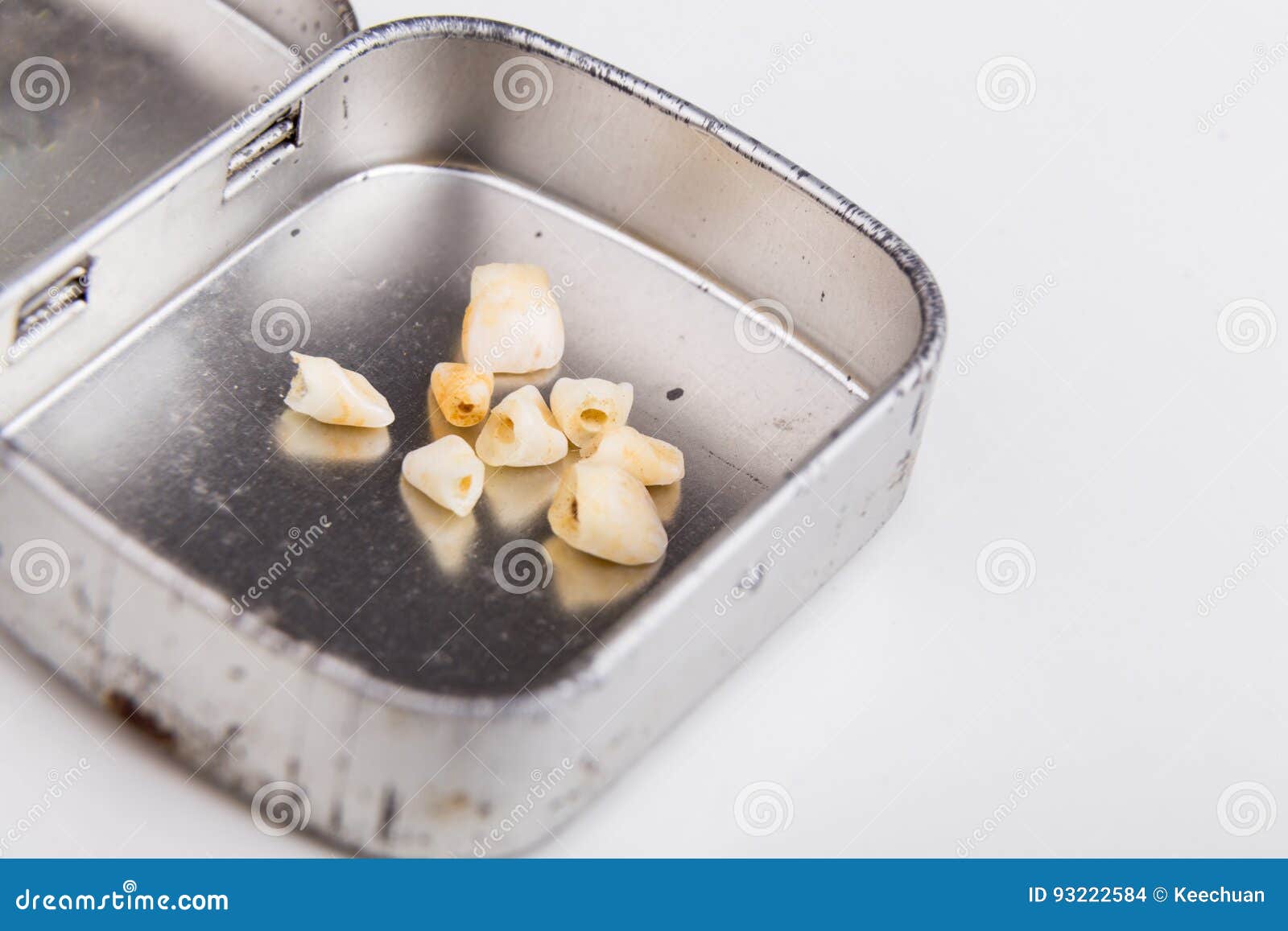 Collection of Extracted Milk Teeth Kept in Box Stock Photo - Image of ...