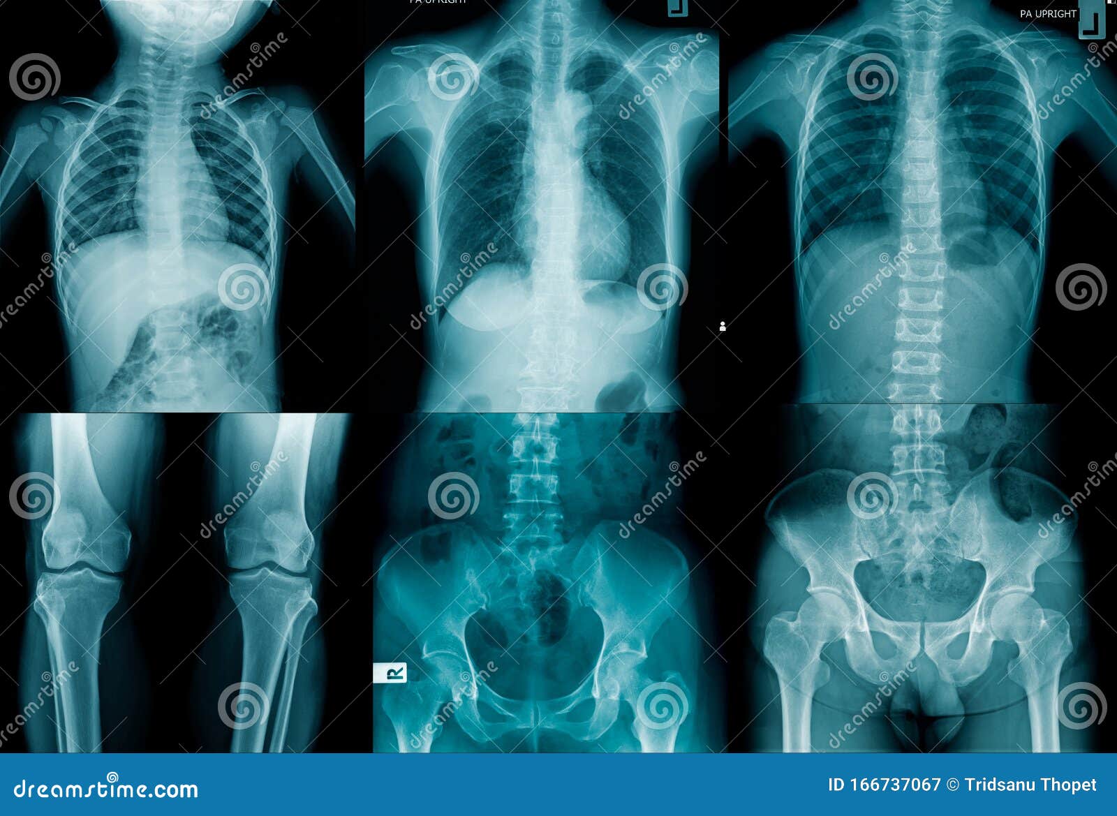 Collection Of Human Skull Royalty-Free Stock Photography ...