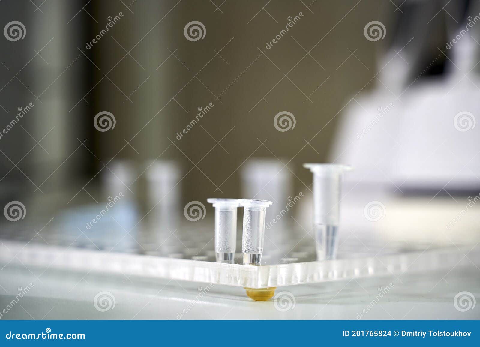 Collection of Patient Tests in the Laboratory Stock Photo - Image of ...