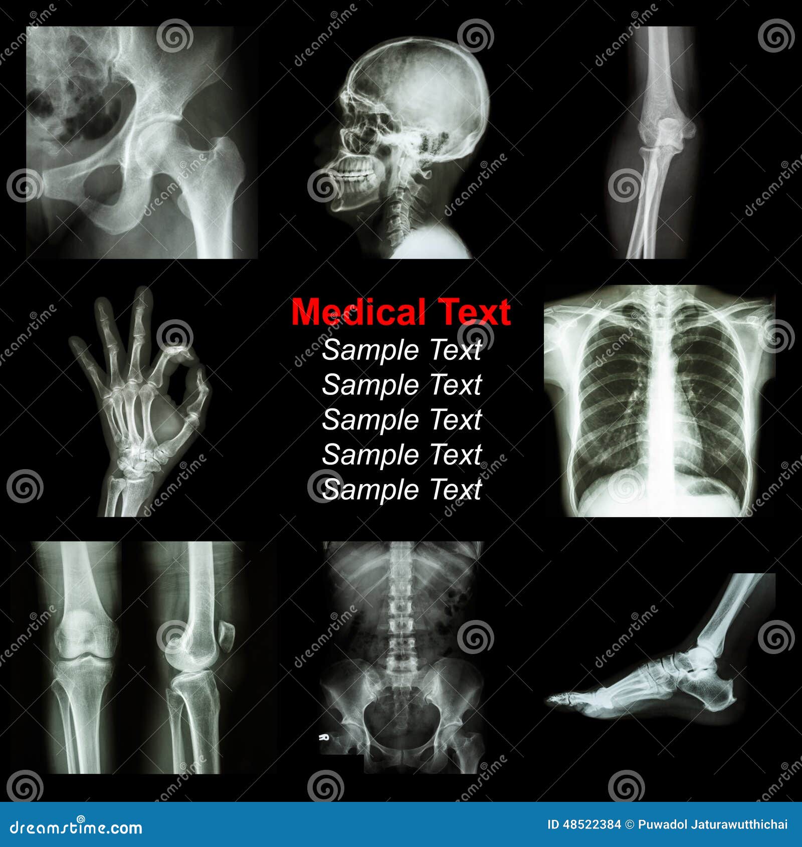 Collection of X-ray Part of Human Stock Photo - Image of orthopedic ...