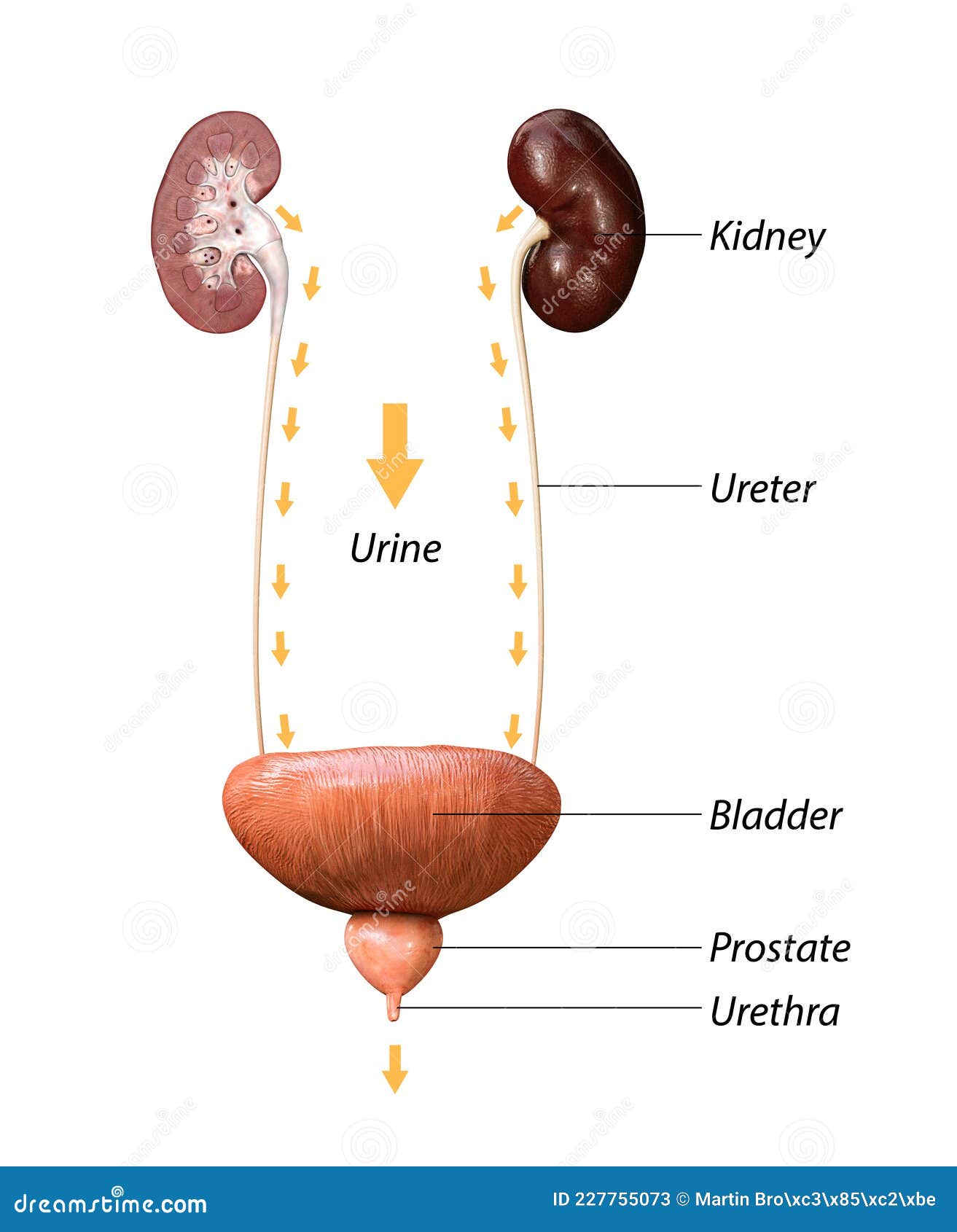 Collection of Urine from the Bladder, Urine Draining from the Kidneys ...