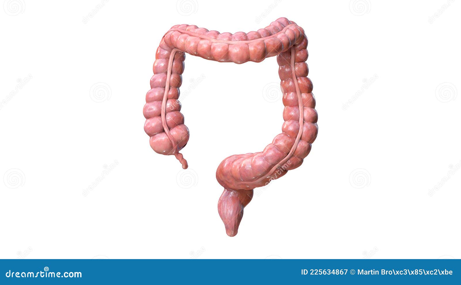 Colon Anatomy - Real View Royalty-Free Stock Photography ...