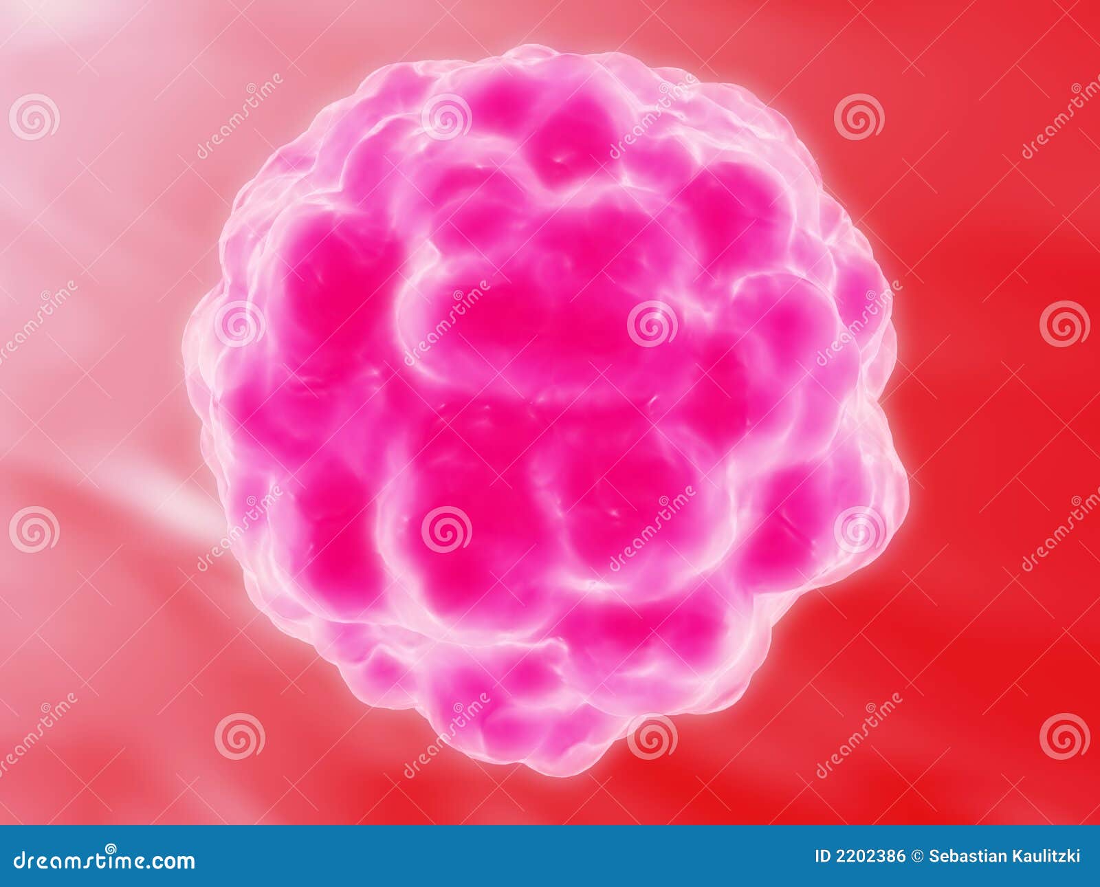 Colon cancer stock illustration. Illustration of tumor - 2202386