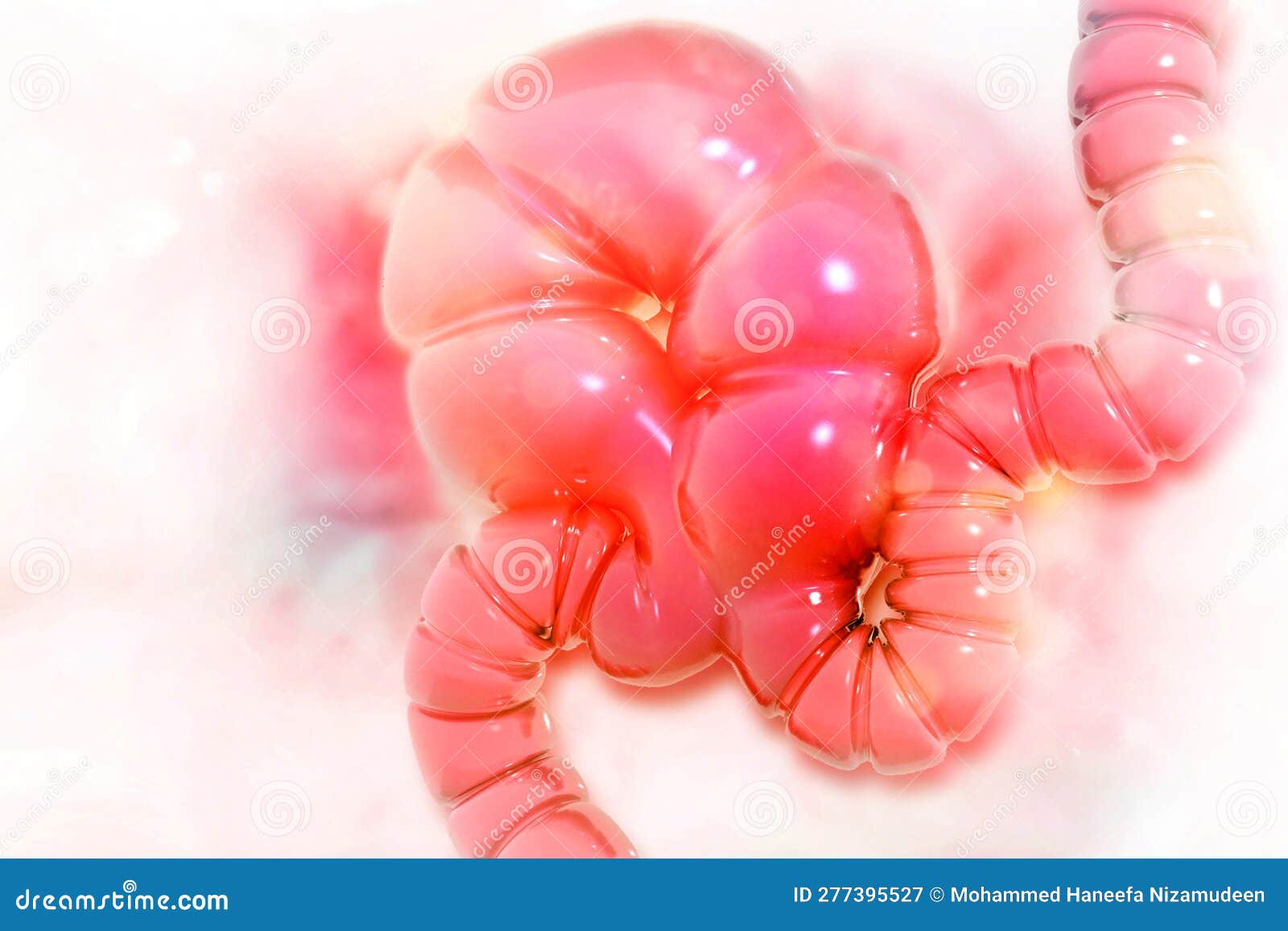 Colon Cancer. Colon Disease Concept Stock Illustration - Illustration ...