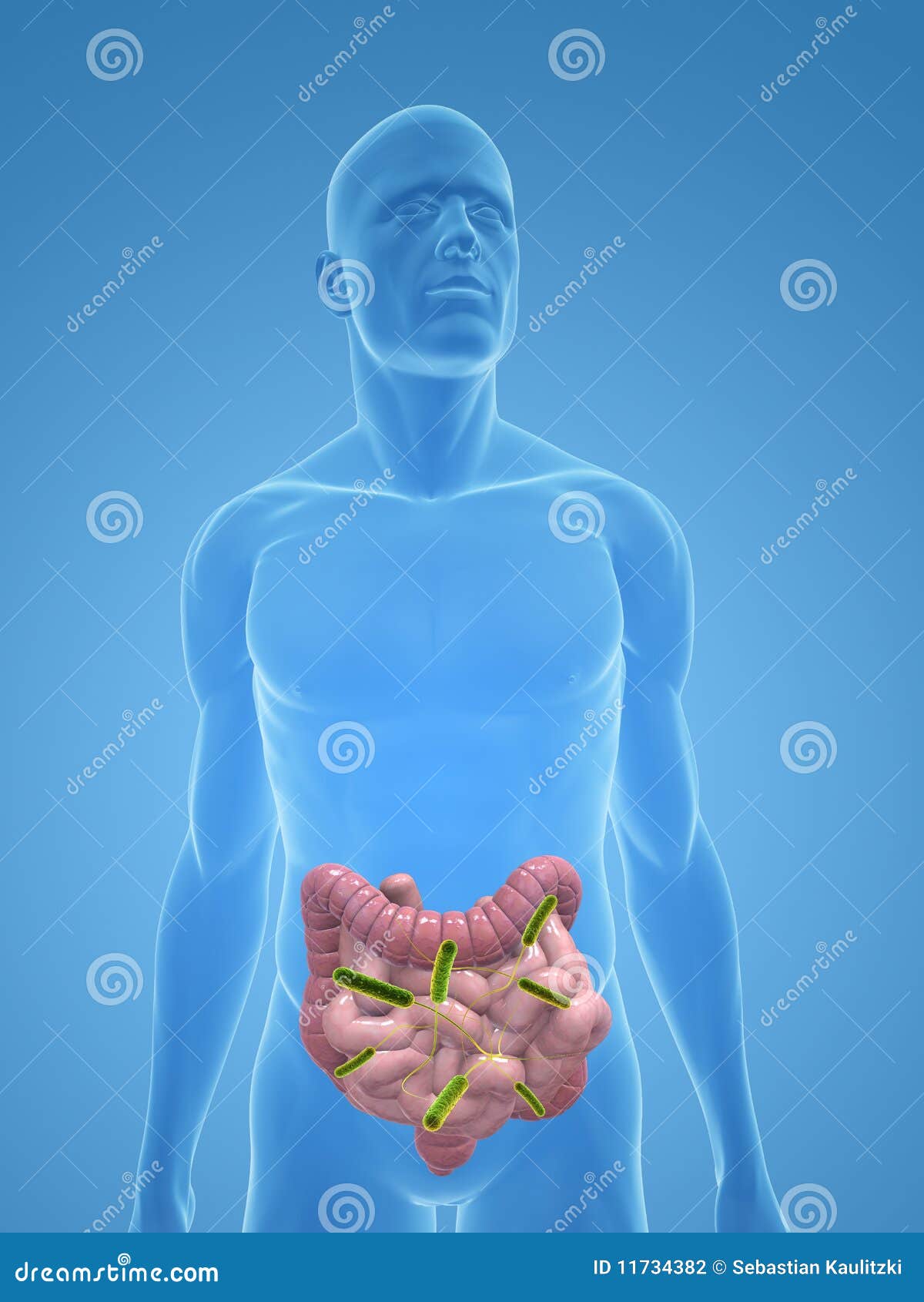 Colon infection stock illustration. Illustration of graphic - 11734382