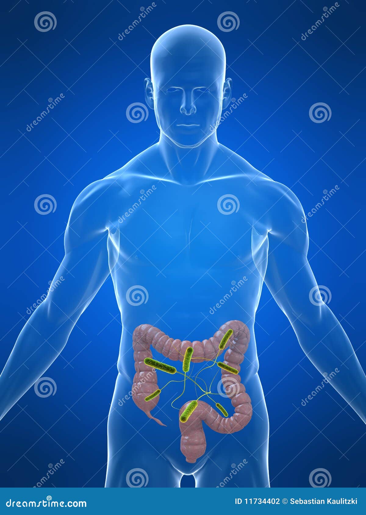 Colon infection stock illustration. Illustration of cancer - 11734402