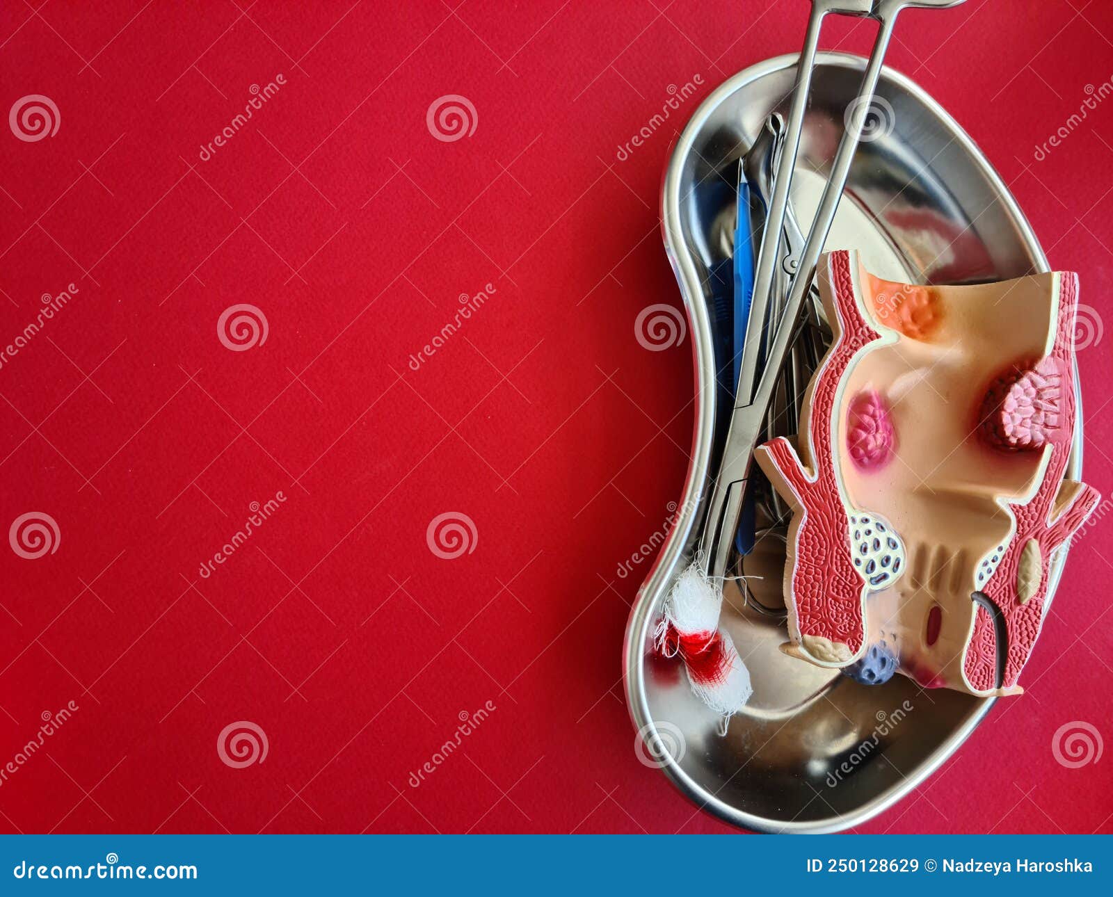 Colon Polyp Removal with Electrical Loop during Colonoscopy Stock Image ...